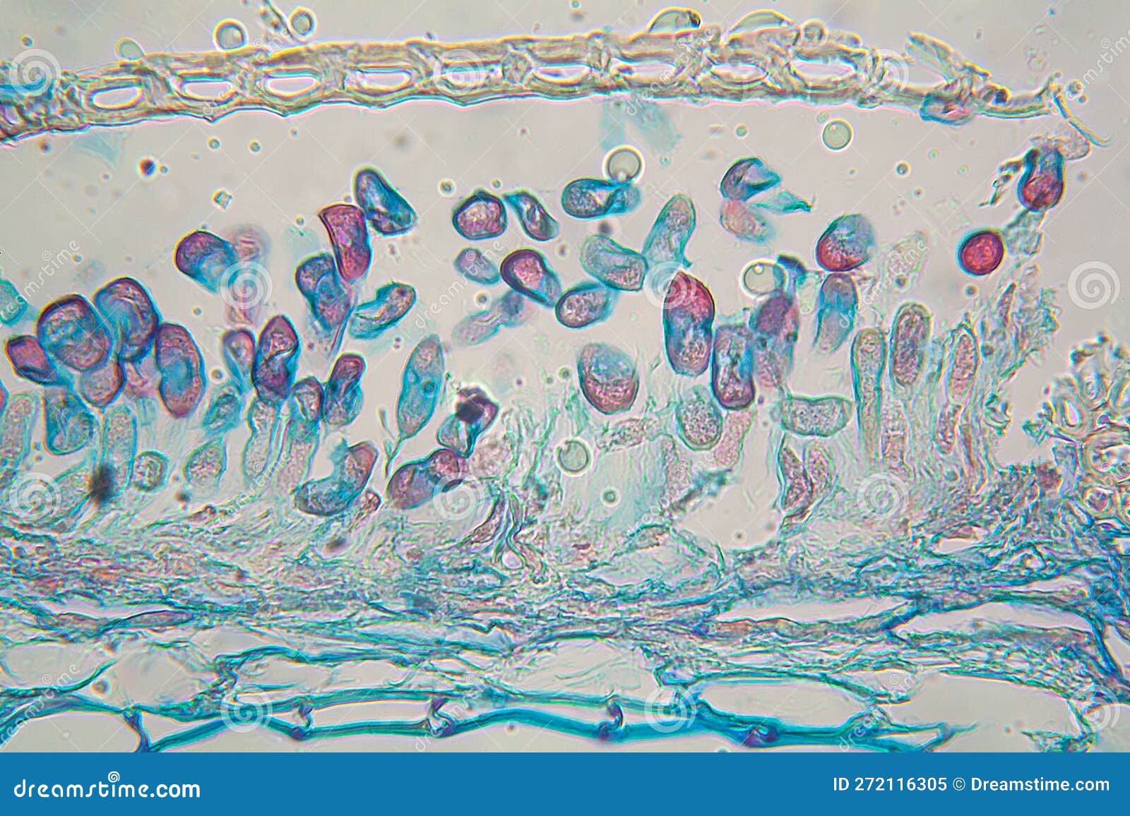 Microscope Photo of Steam Rust, Puccinia Graminis Stock Image - Image ...