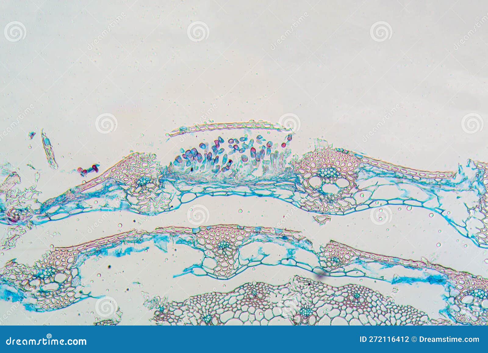Microscope Photo of Steam Rust, Puccinia Graminis Stock Photo - Image ...