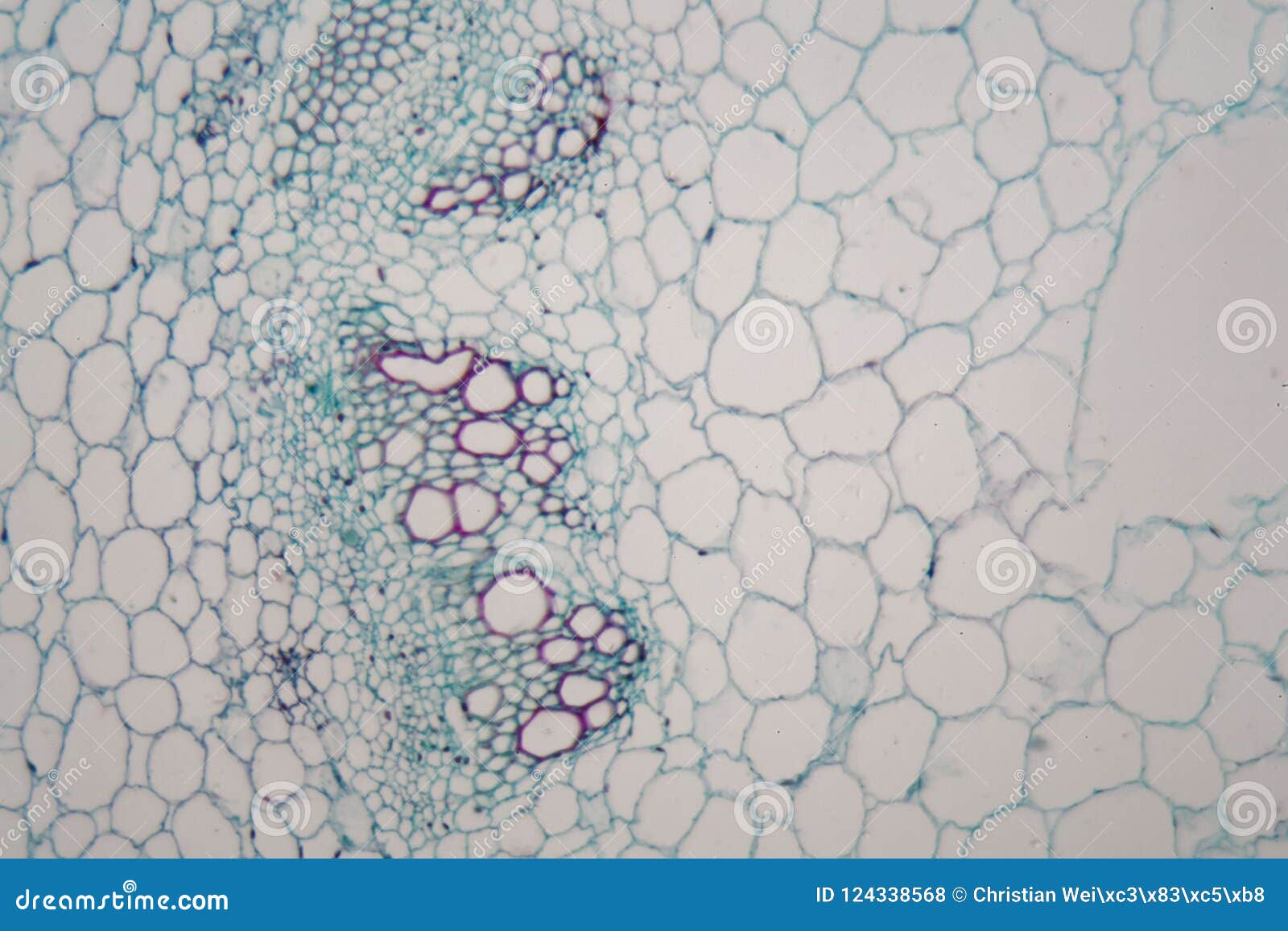 Microscope Photo of a Sunflower Stem. Stock Photo - Image of anatomy ...