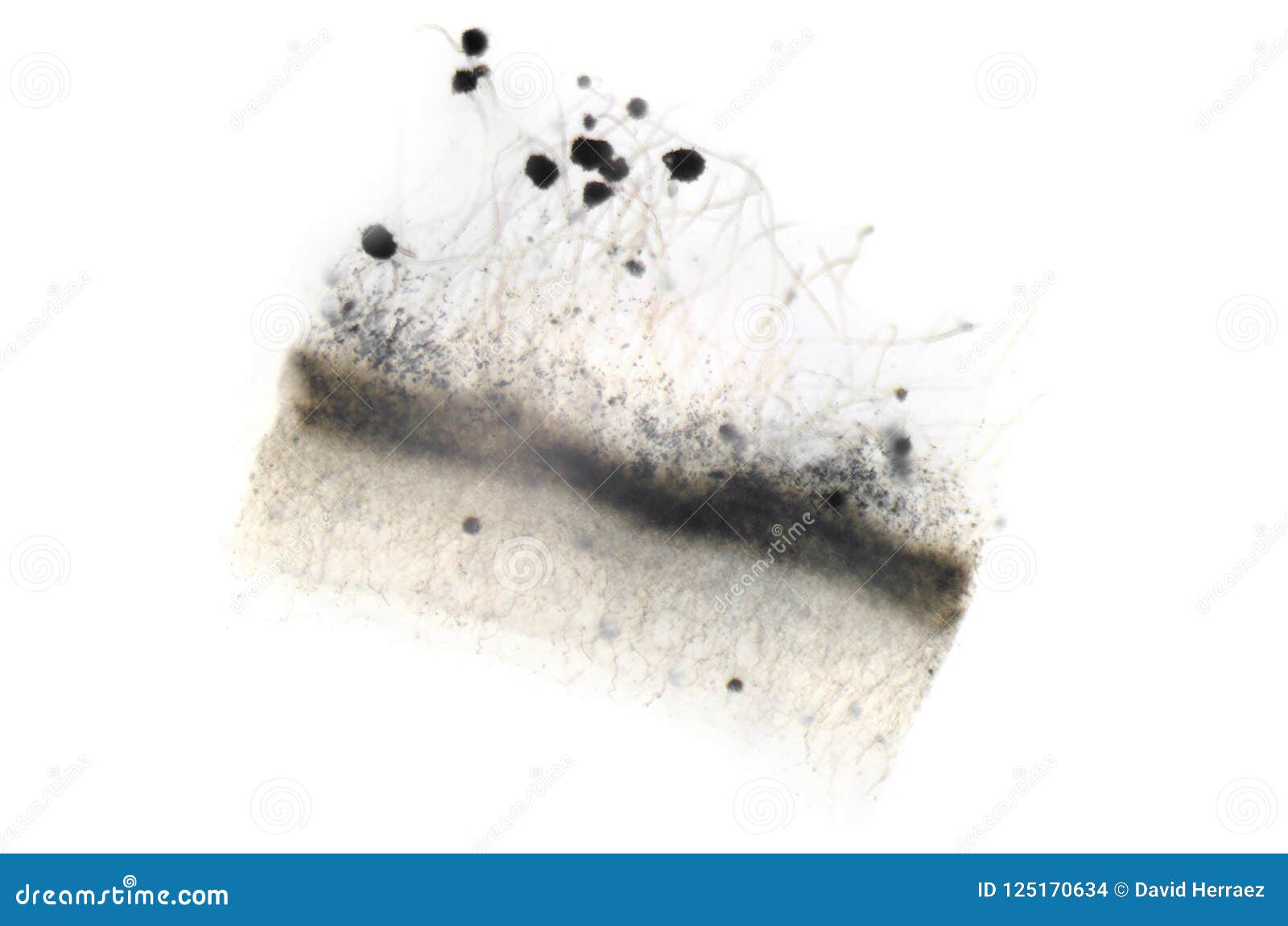 Microscope Photography of Aspergillus Mold Stock Photo - Image of ...