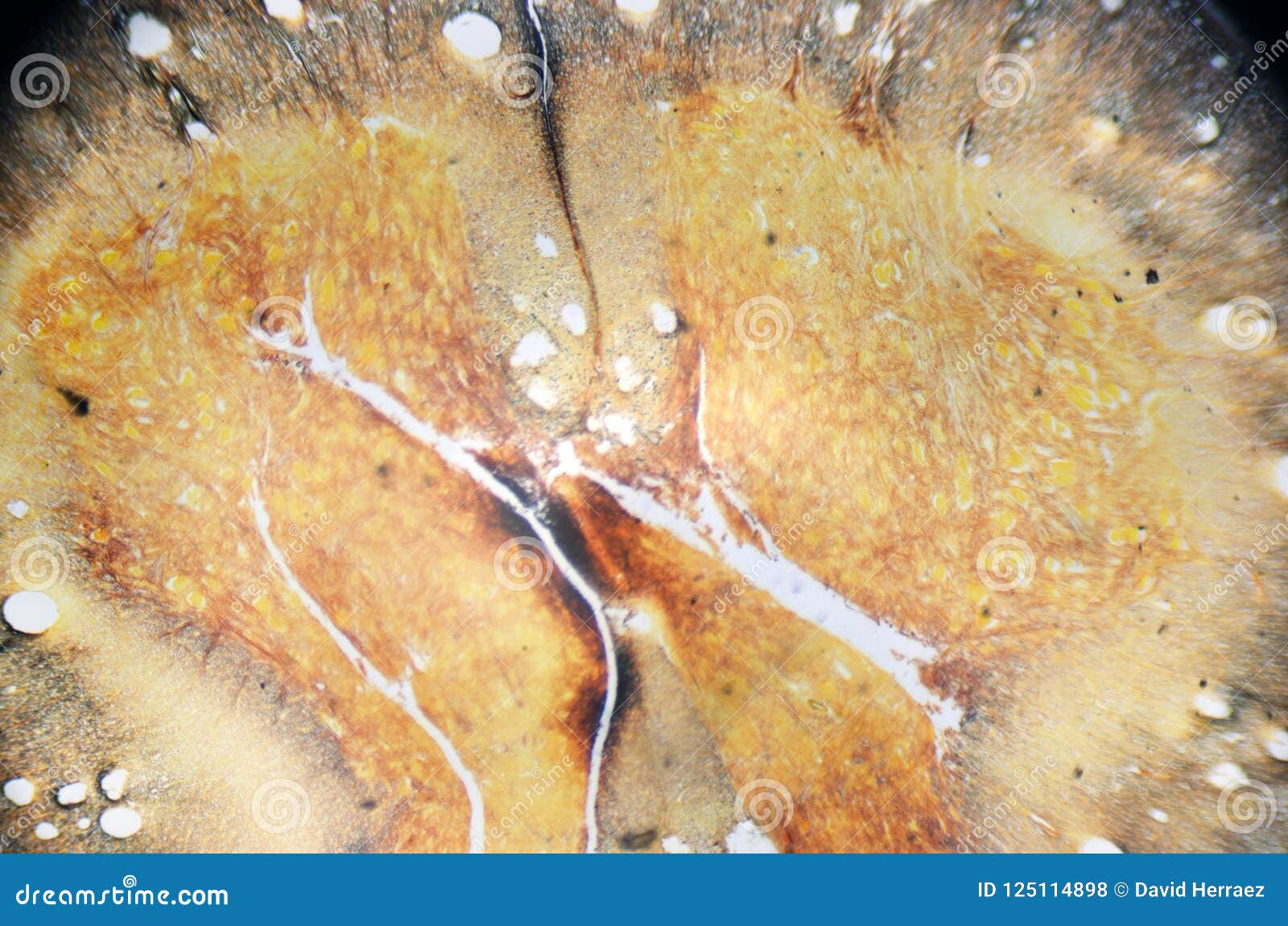 Microscope Photography. Spinal Cord, Cross Section. Stock Photo - Image ...