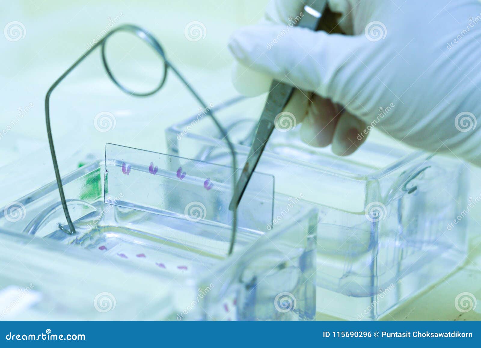 Microscope Slide Staining Tissue Biopsy For Diagnosis In Pathology ...