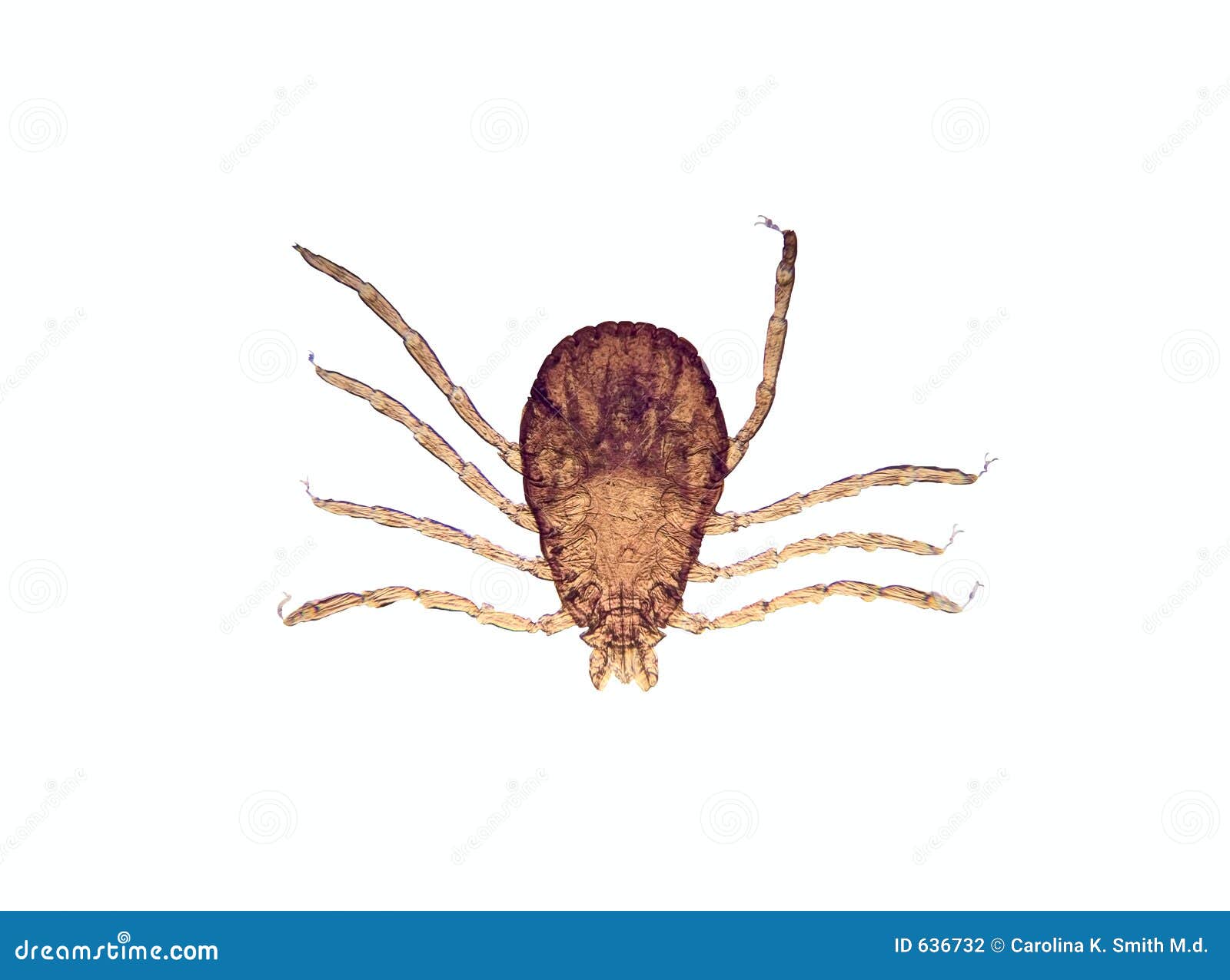 Microscope - Tick (Rhipicephalus Sanguineus) Stock Photo - Image of ...