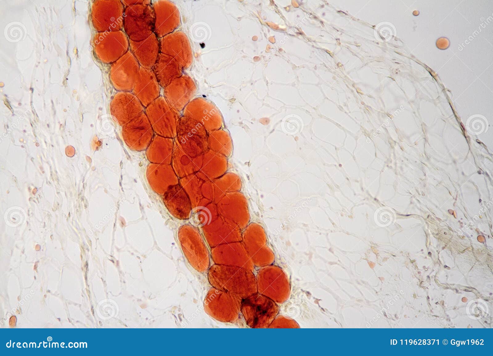 Microscope View Of Adipose Tissue Stock Image Image Of Fitness Microscope 119628371