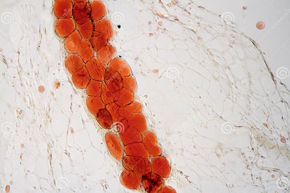 Microscope View of Adipose Tissue Stock Image - Image of fitness ...