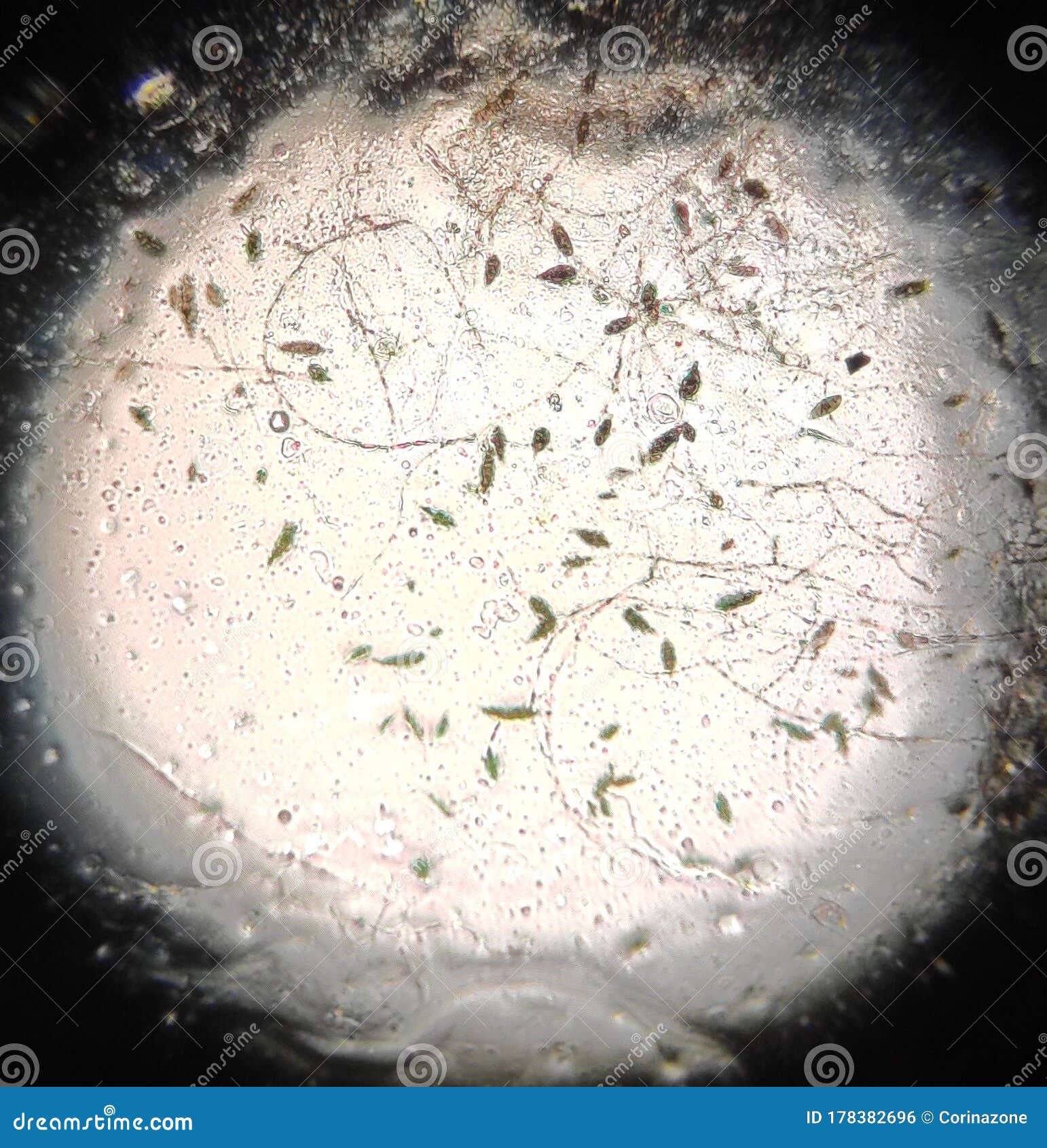 Microscopy of the Alternaria Fungal Mycelium Stock Photo - Image of ...