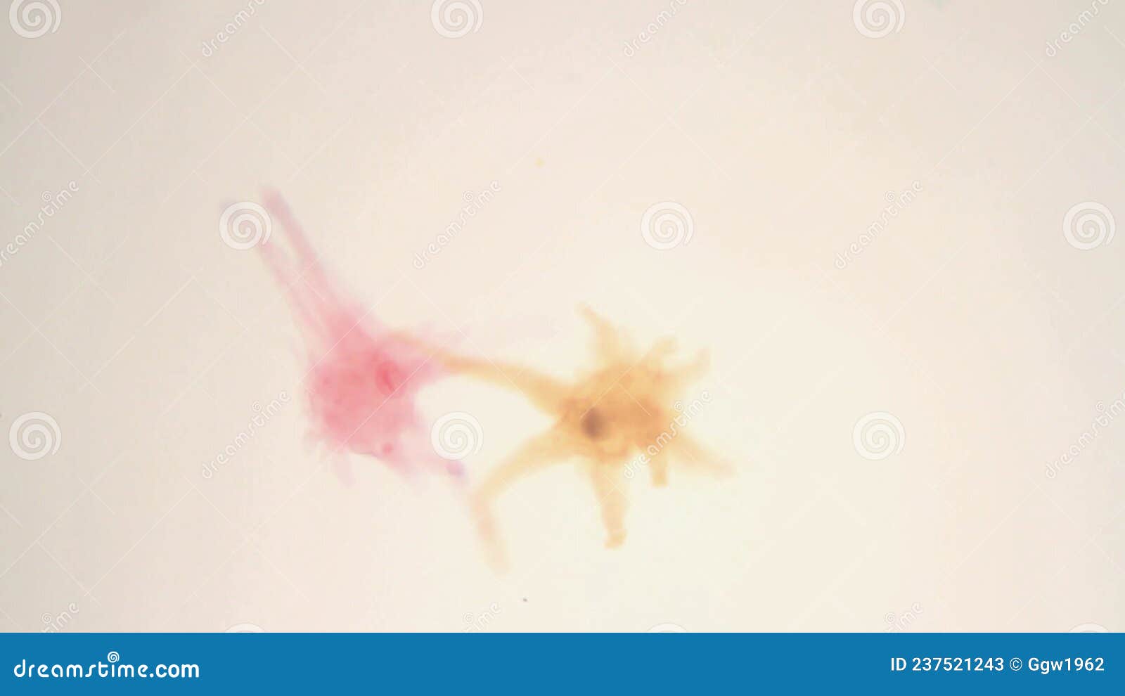 Microscope View of an Amoeba Stock Video - Video of university ...