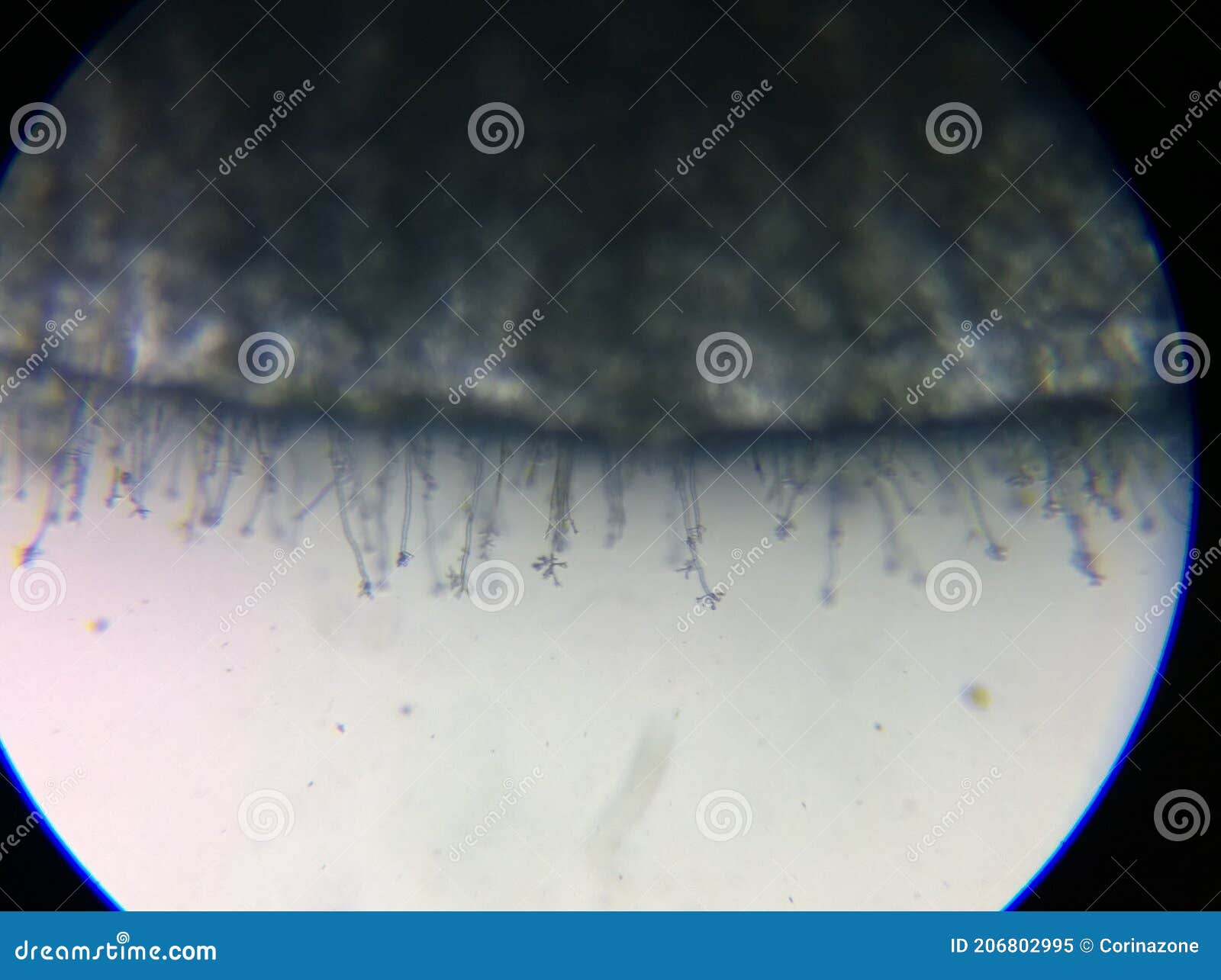 Microscope View of an Aspergillus Genus Mold Stock Image - Image of ...