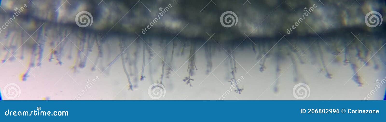 Microscope View of an Aspergillus Genus Mold Stock Photo - Image of ...