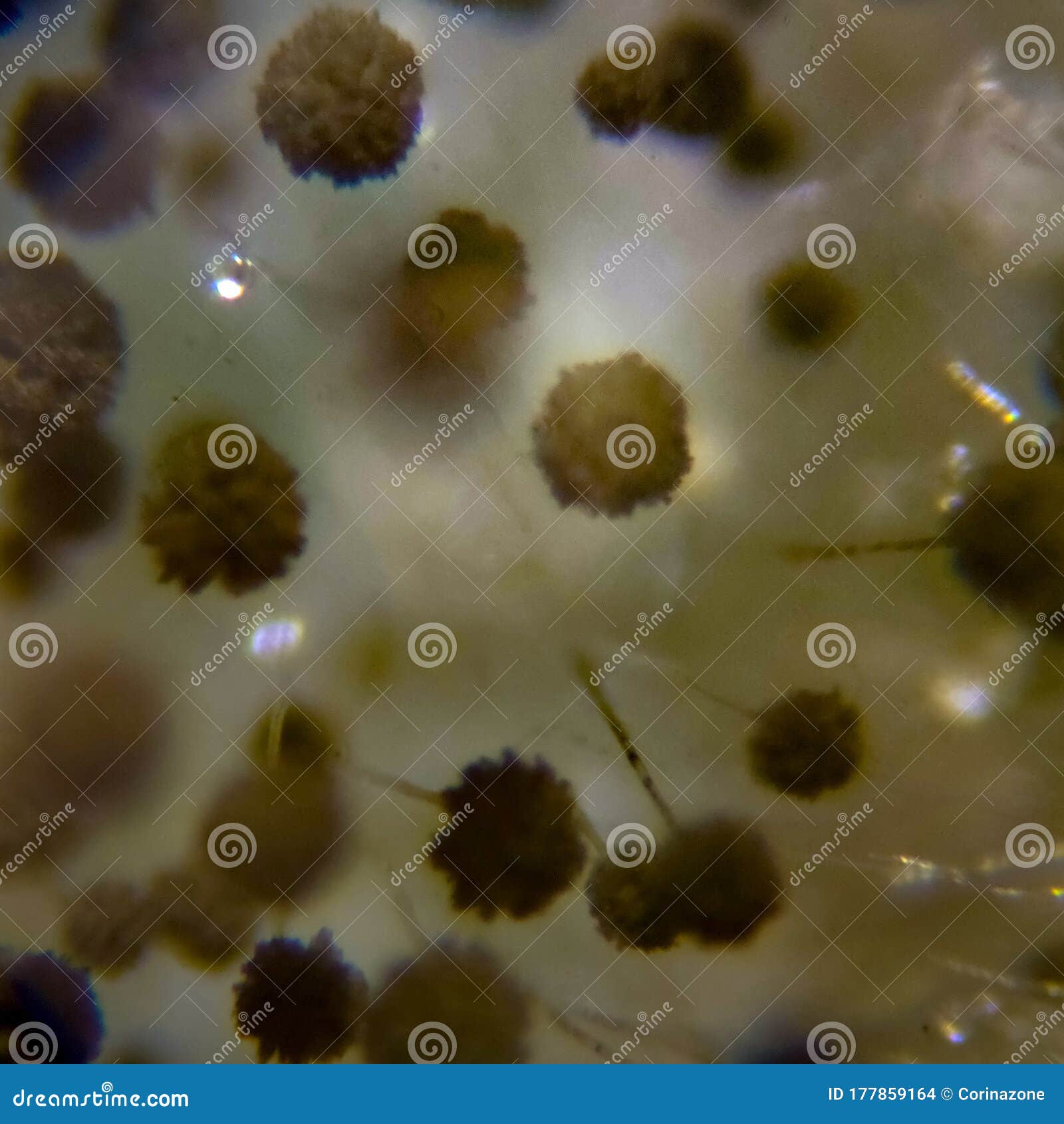 Aspergillus Niger Under the Microscope Stock Photo - Image of view ...