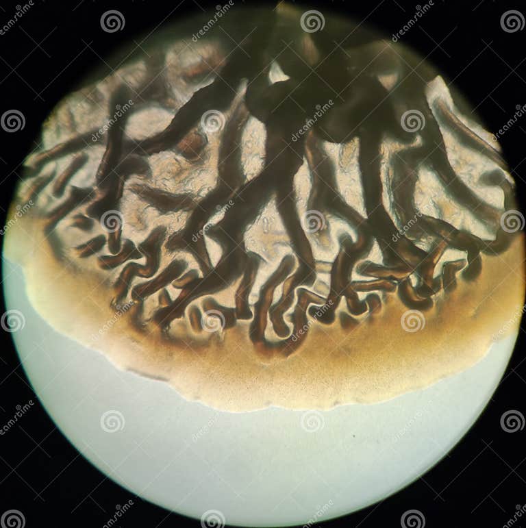 Microscope View of a Bacillus Genus Bacterial Colony Stock Photo ...