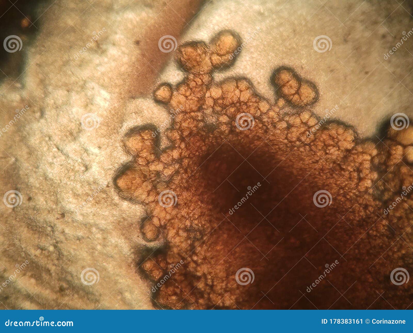 Microscope View of Bacteria Growing in Beautiful Fractal Pattern ...