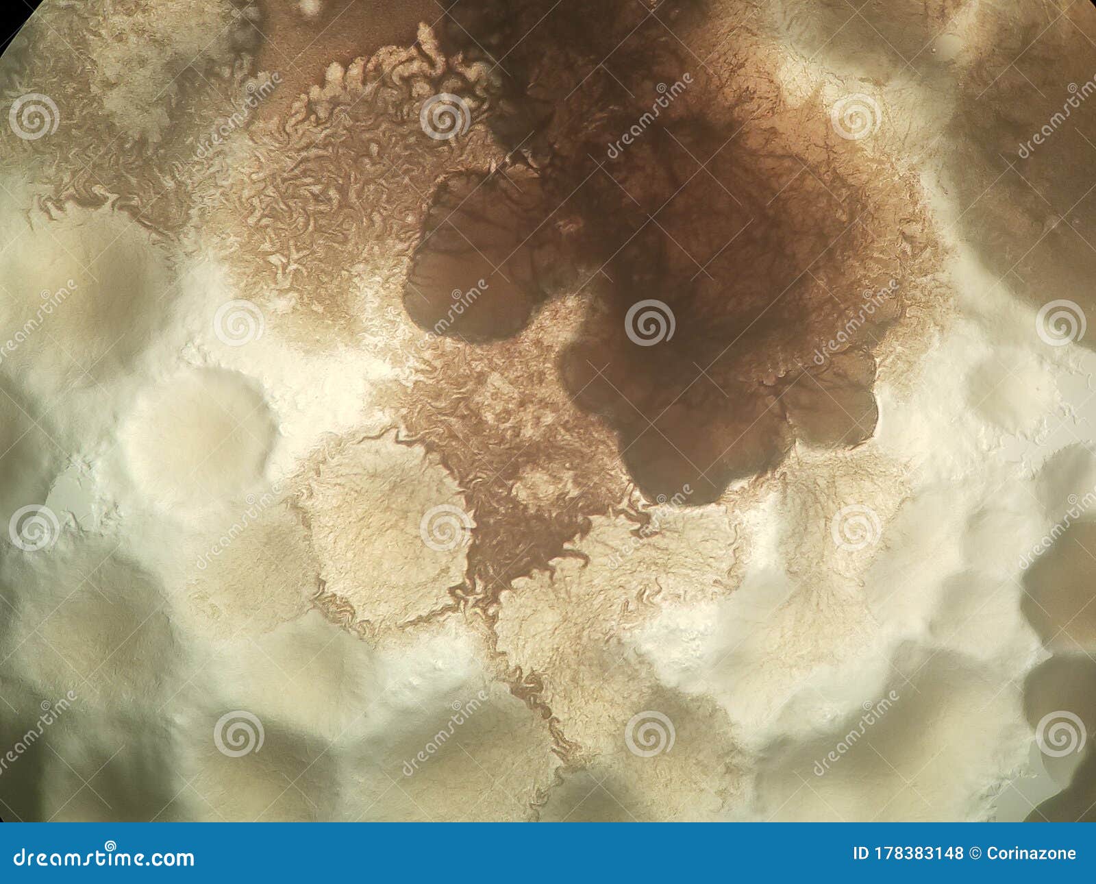 Microscope View of Bacteria Growing in Beautiful Fractal Pattern ...