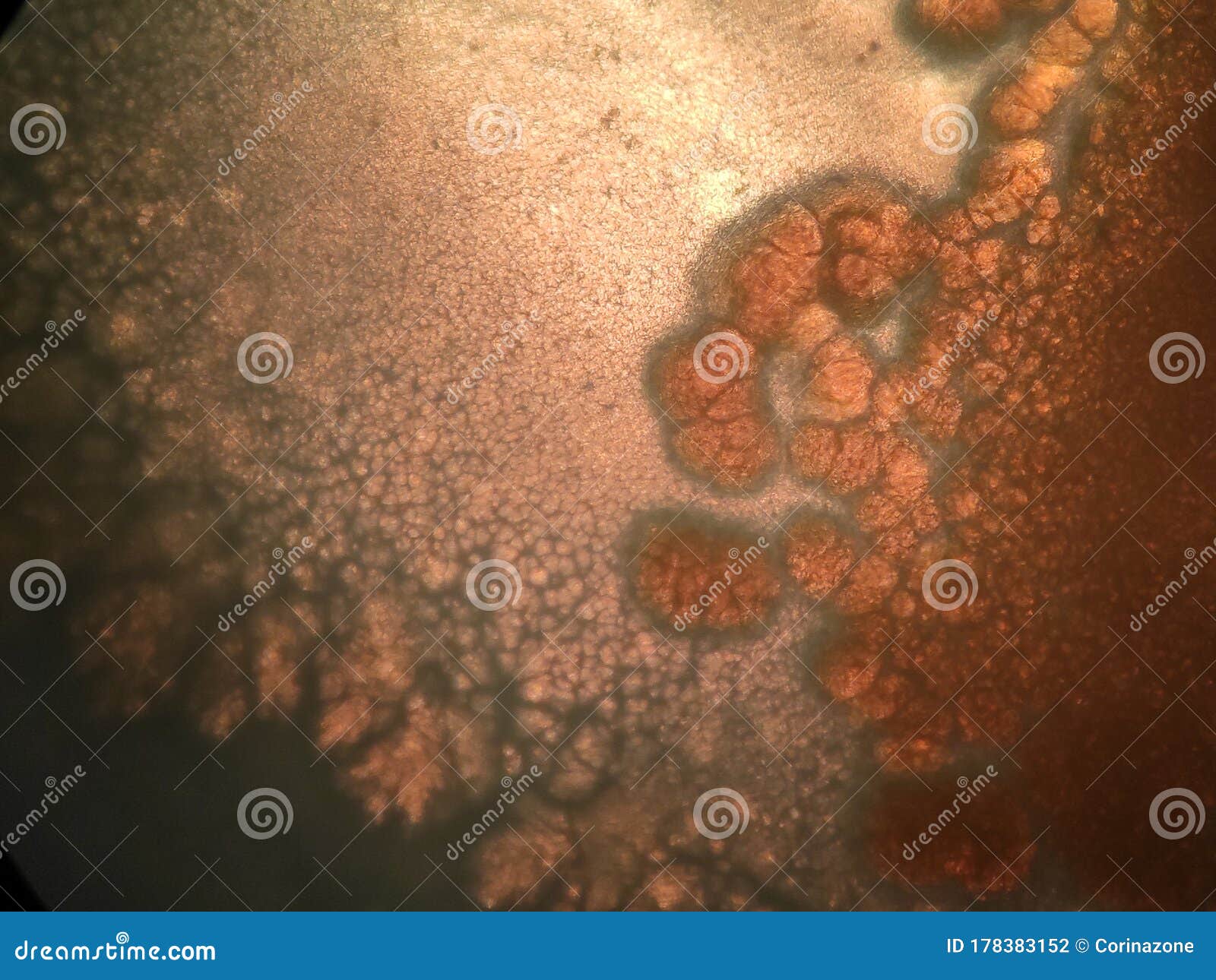 Microscope View of Bacteria Growing in Beautiful Fractal Pattern ...