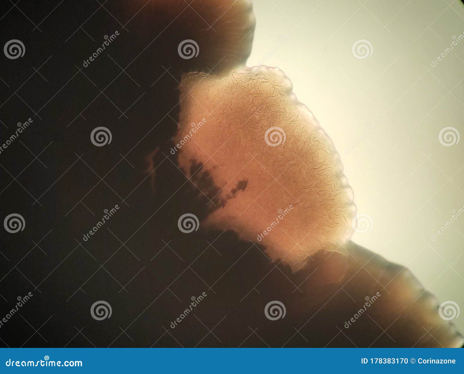 Microscope View of Bacteria Growing in Beautiful Fractal Pattern ...