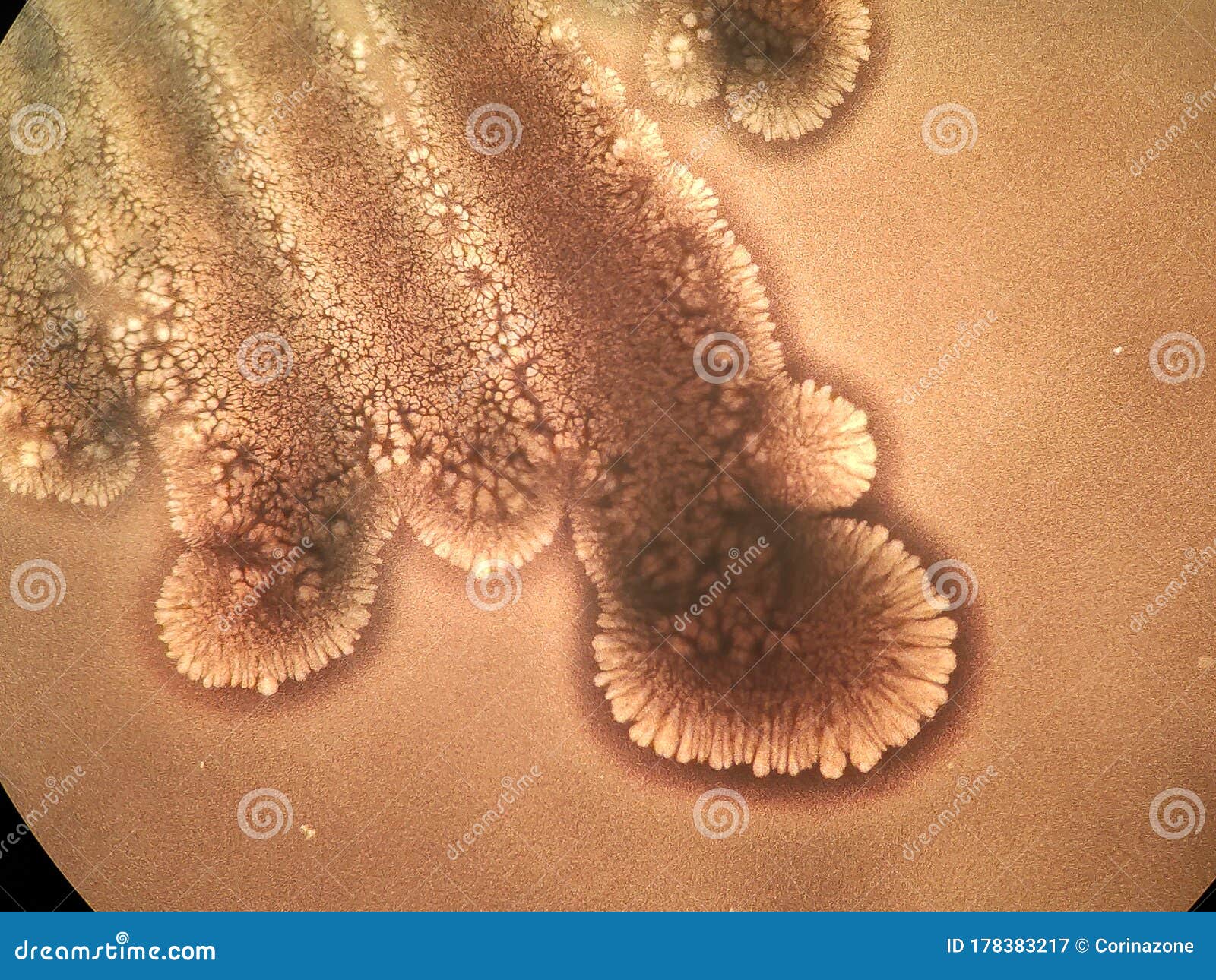 Microscope View of Bacteria Growing in Beautiful Fractal Pattern ...