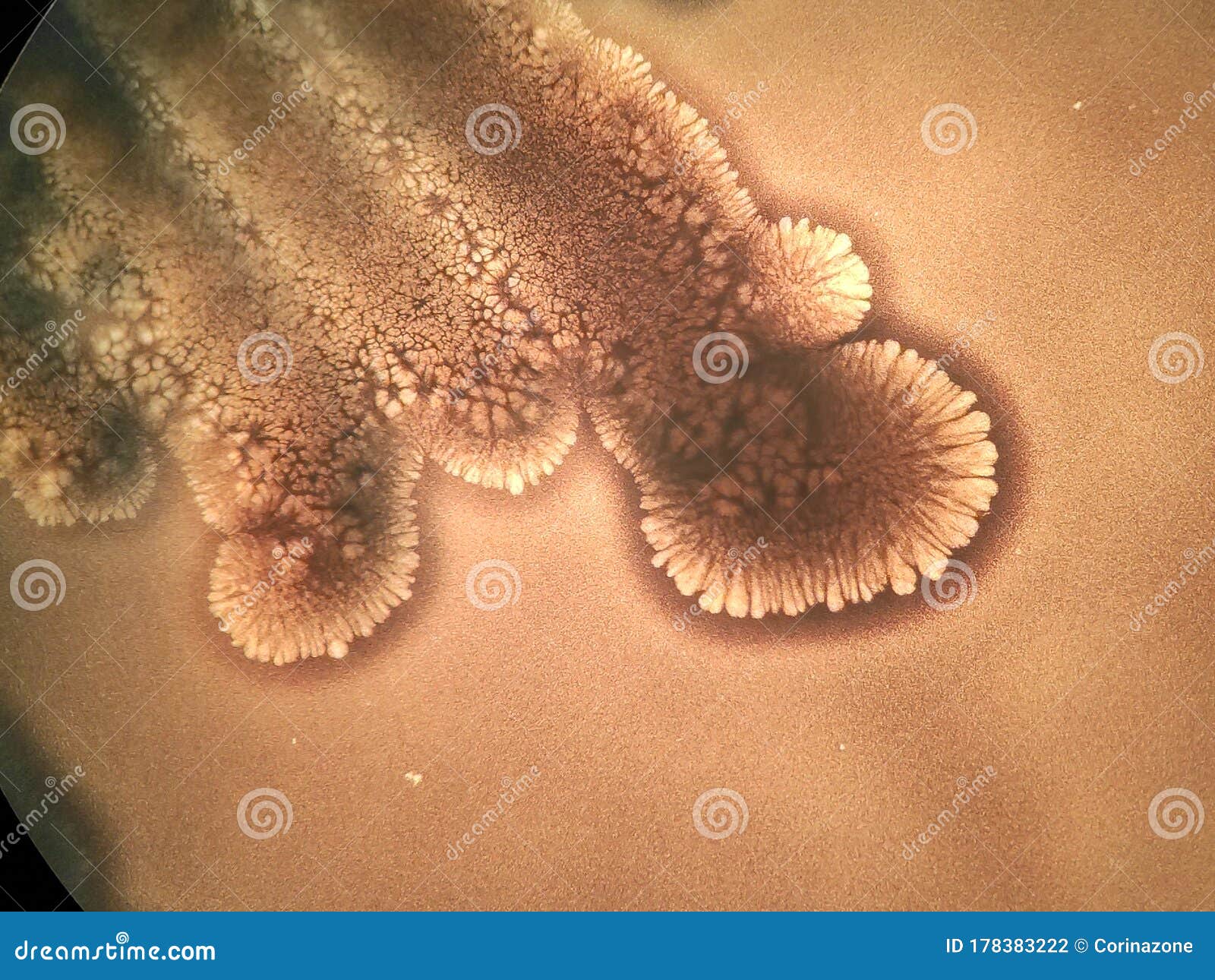 Microscope View of Bacteria Growing in Beautiful Fractal Pattern ...