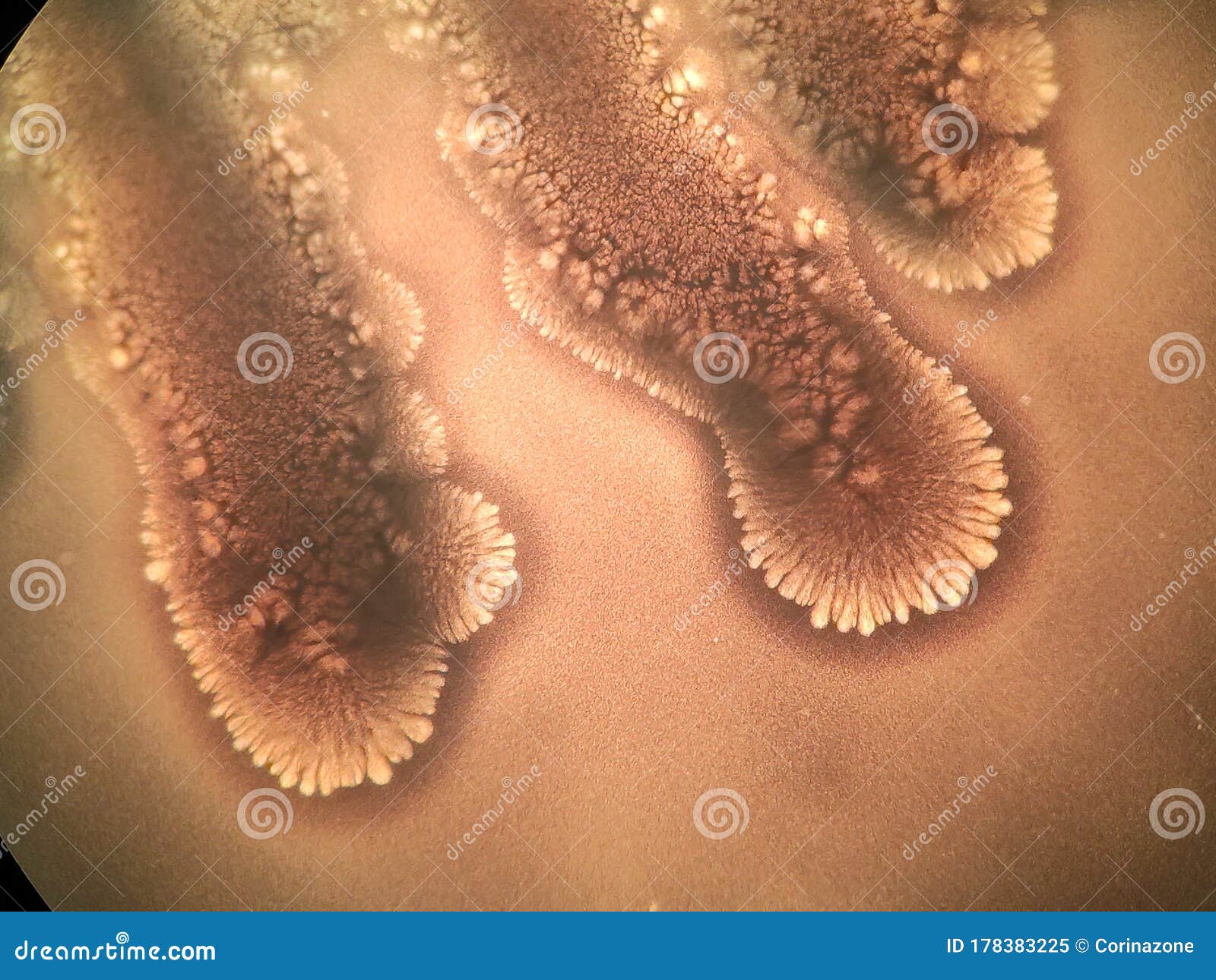 Microscope View of Bacteria Growing in Beautiful Fractal Pattern ...