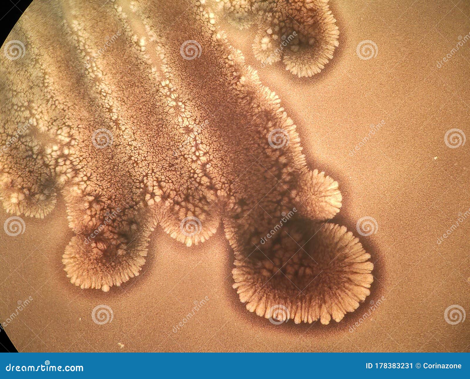 Microscope View of Bacteria Growing in Beautiful Fractal Pattern ...