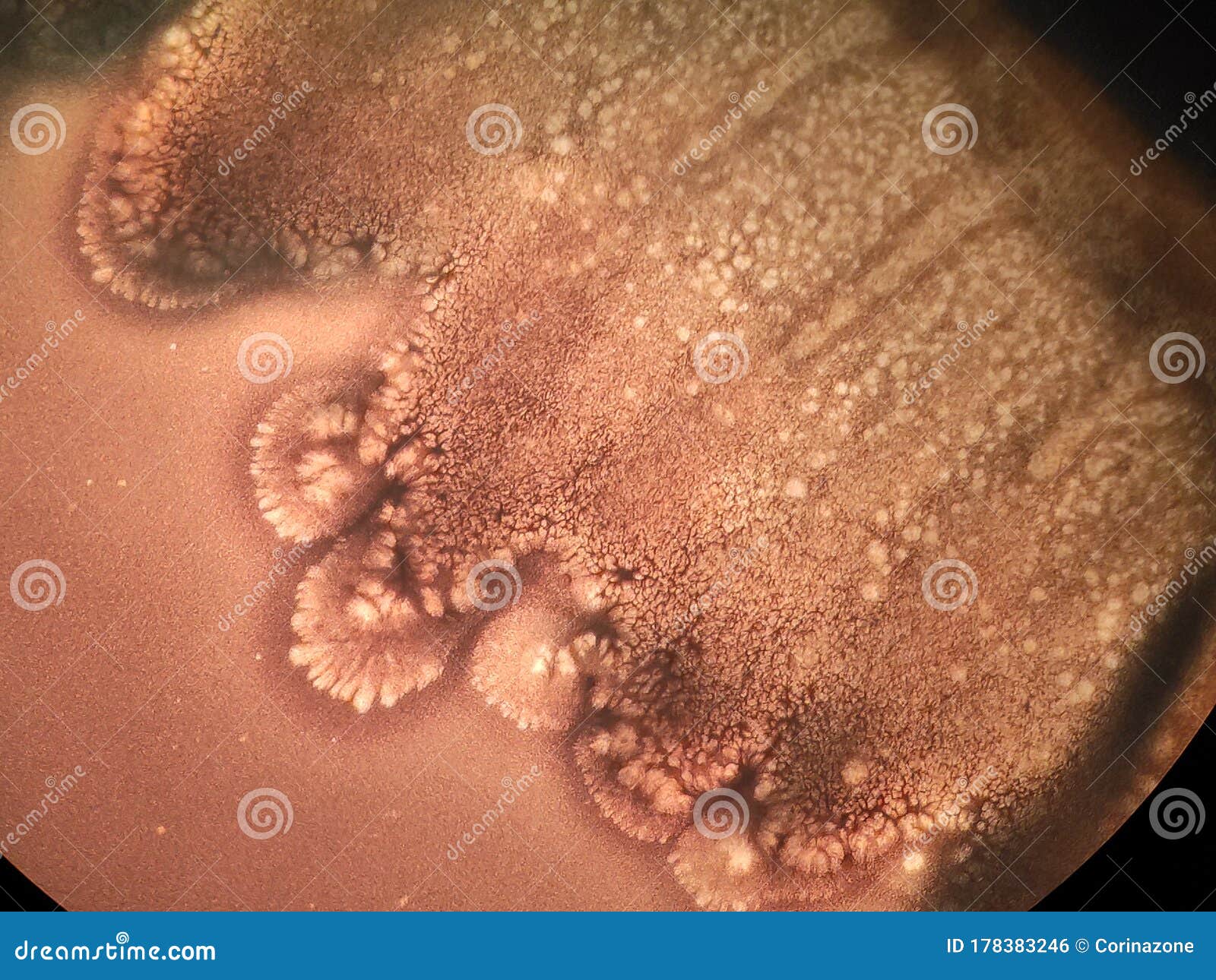 Microscope View of Bacteria Growing in Beautiful Fractal Pattern ...