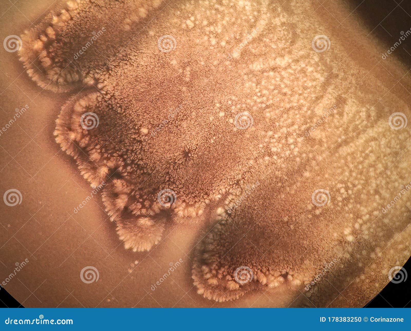 Microscope View of Bacteria Growing in Beautiful Fractal Pattern ...