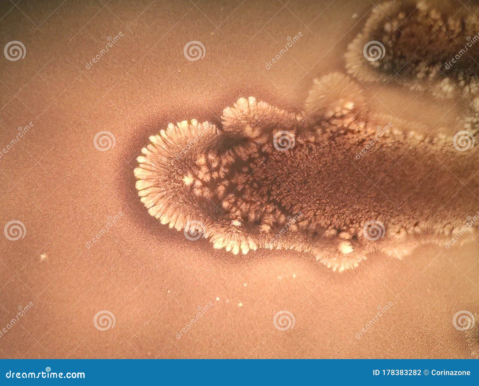 Microscope View of Bacteria Growing in Beautiful Fractal Pattern ...