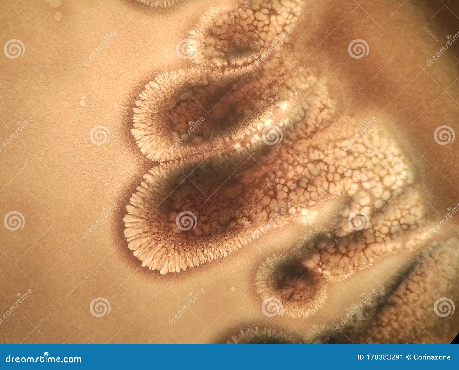 Microscope View of Bacteria Growing in Beautiful Fractal Pattern ...