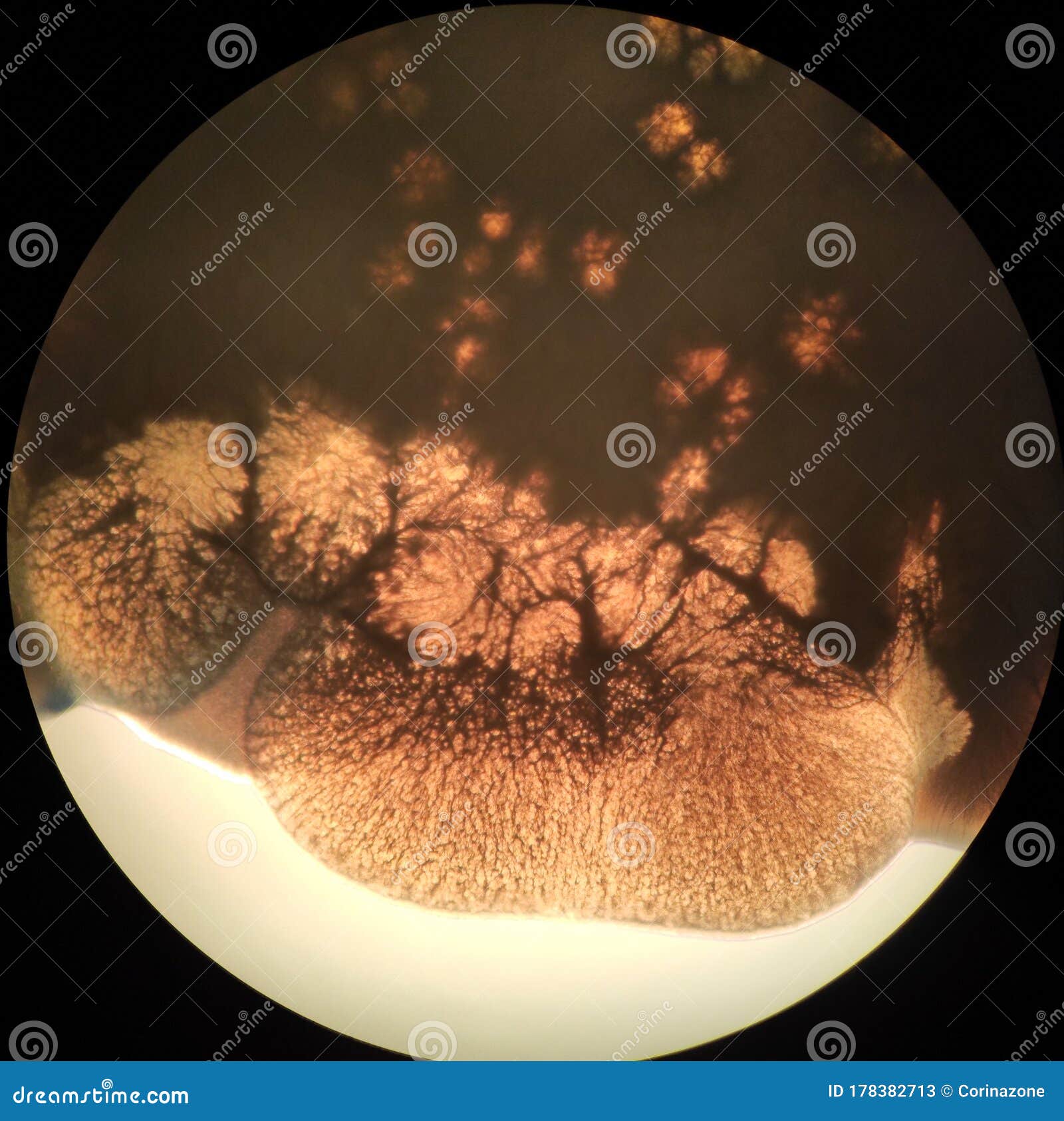 Beautiful Bacterial Growth Under the Microscope Stock Image - Image of ...