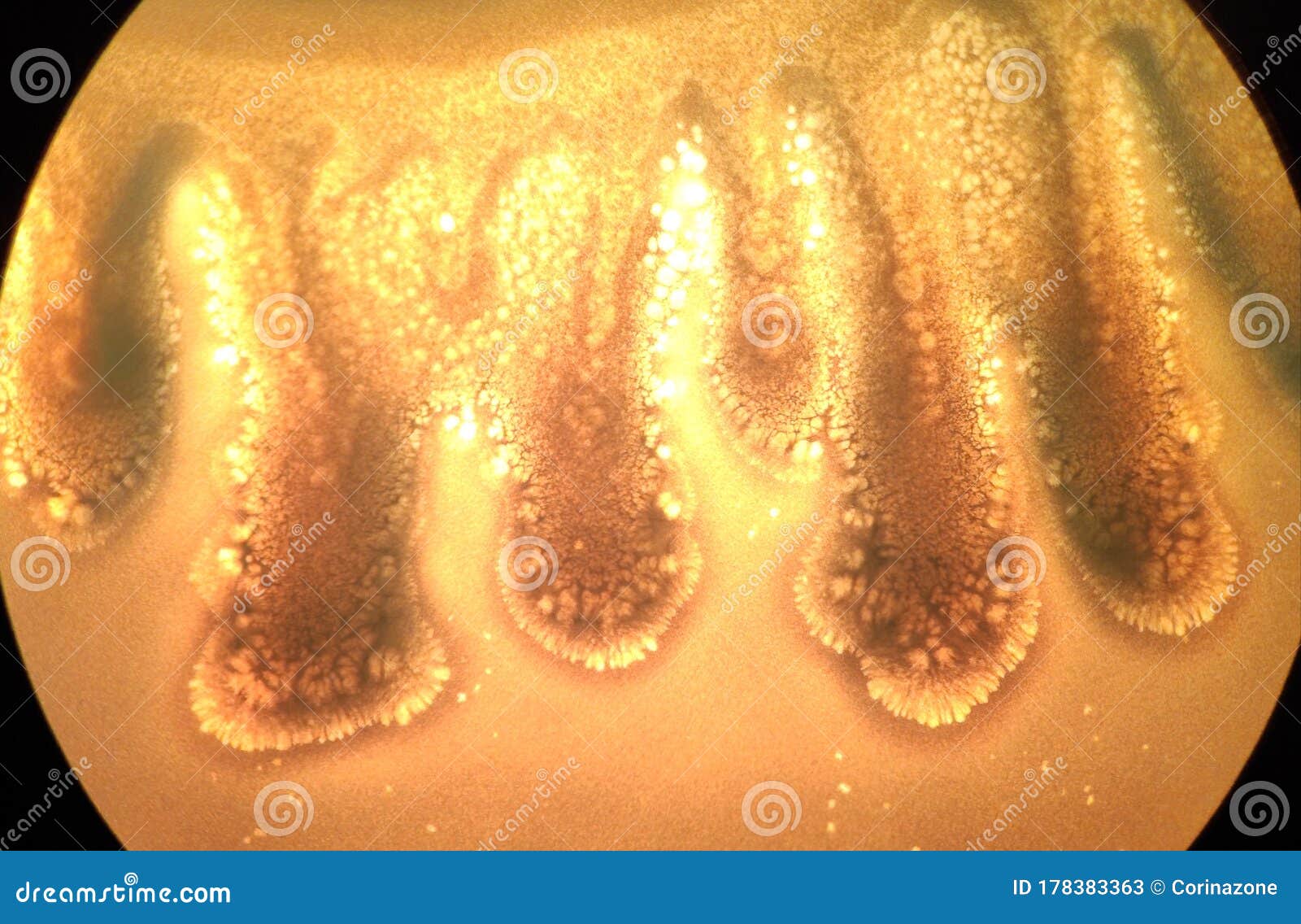 Structures Built by Bacteria Under the Microscope - Beautiful Growth ...