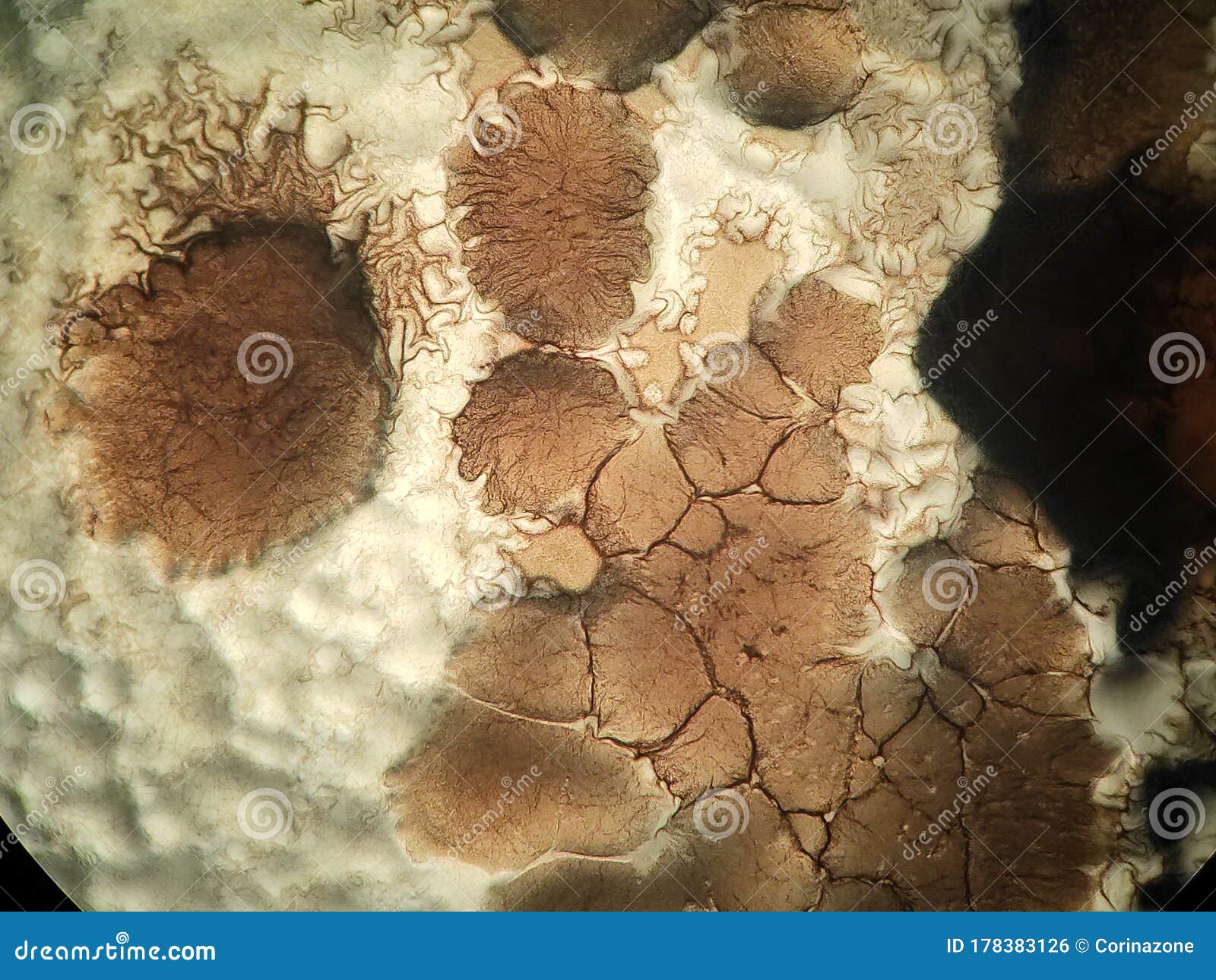Microscope View of Bacteria Growing in Beautiful Structures Stock Photo ...
