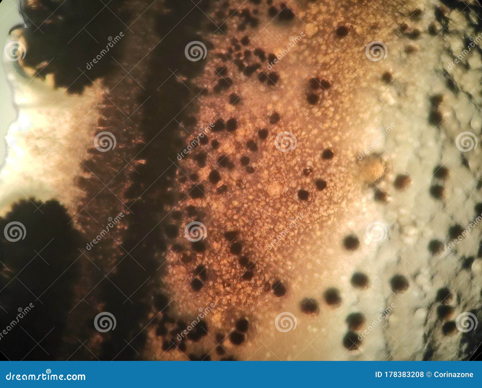Microscope View Of Bacteria Growing In Beautiful Structures Royalty ...
