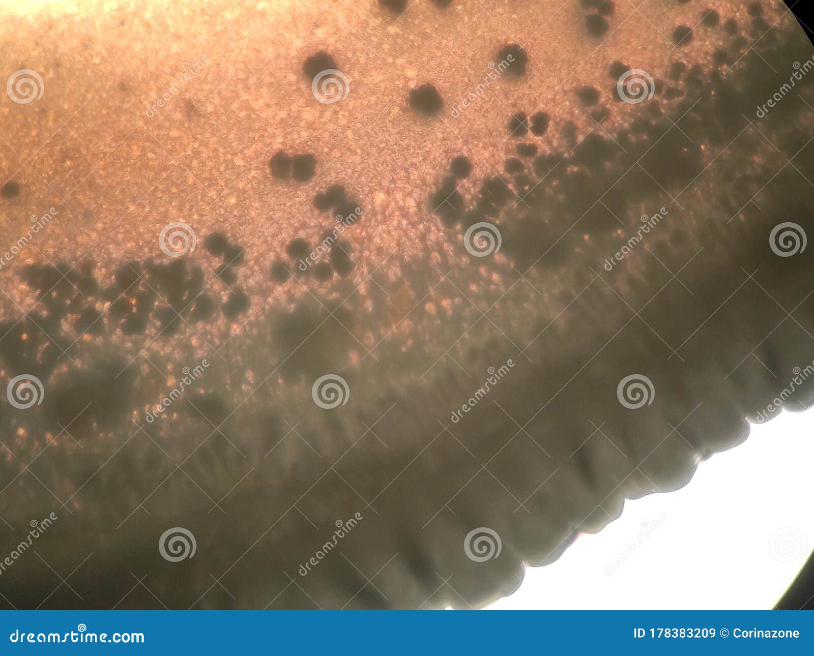 Microscope View Of Bacteria Growing In Beautiful Structures Royalty ...