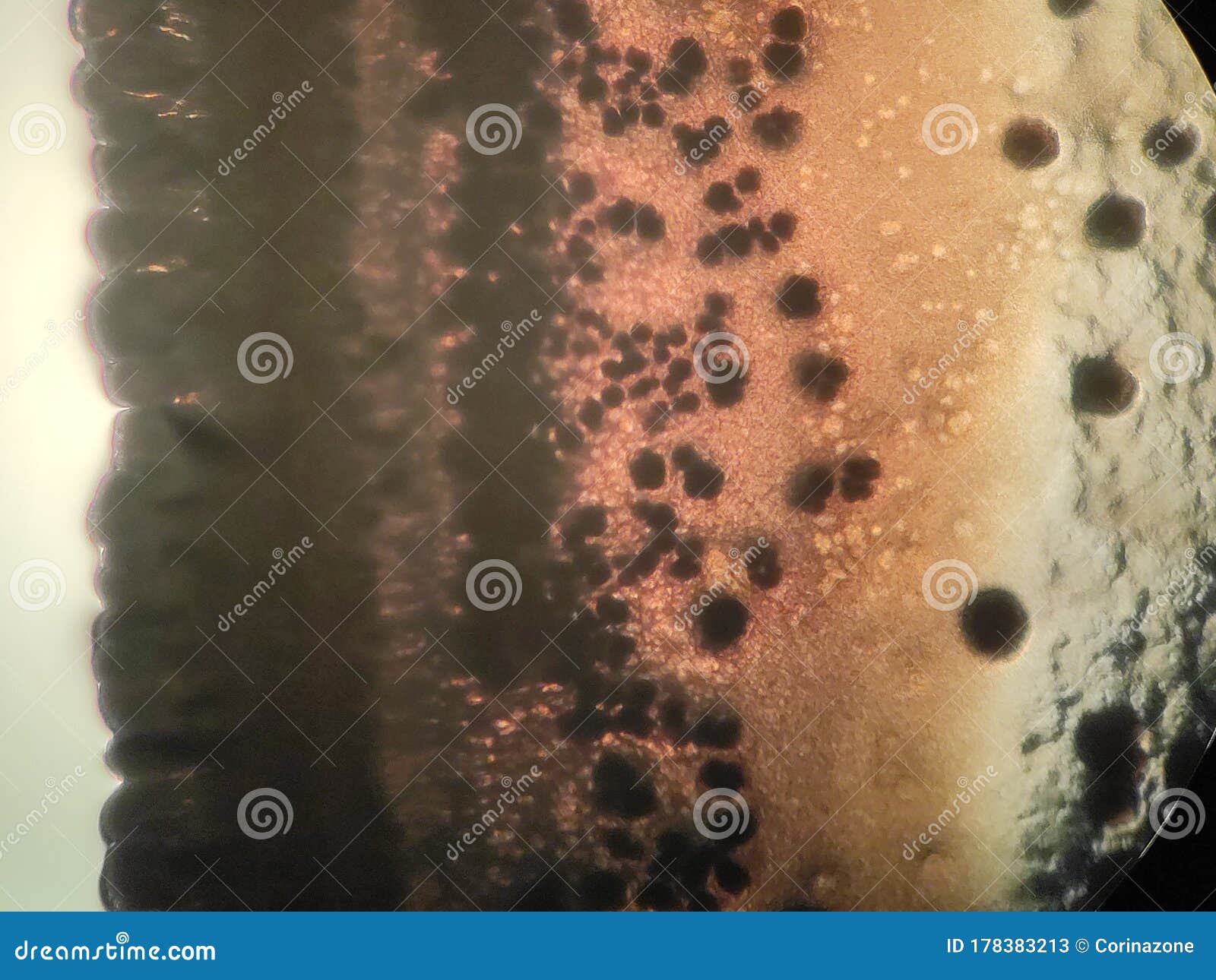 Microscope View of Bacteria Growing in Beautiful Structures Stock Image ...
