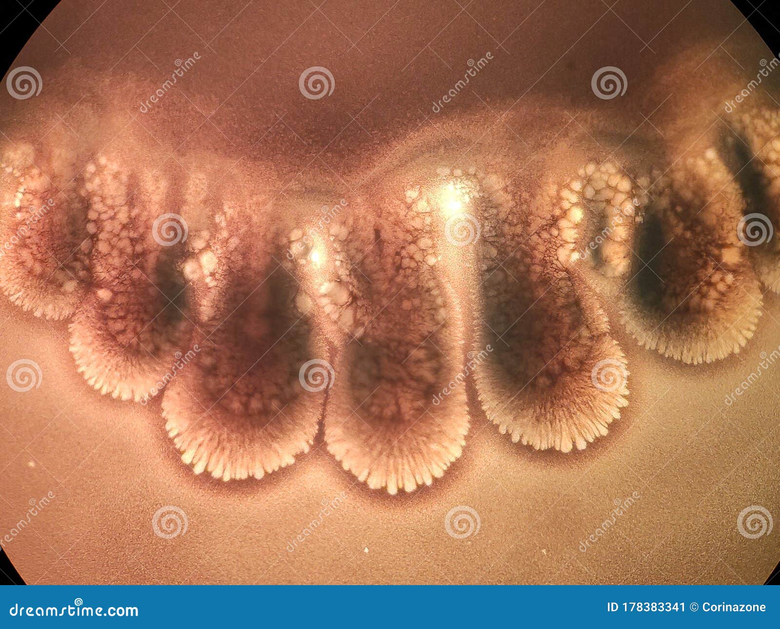 Beuatiful Fractal Pattern Bacterial Colonies Under the Microscope Stock ...