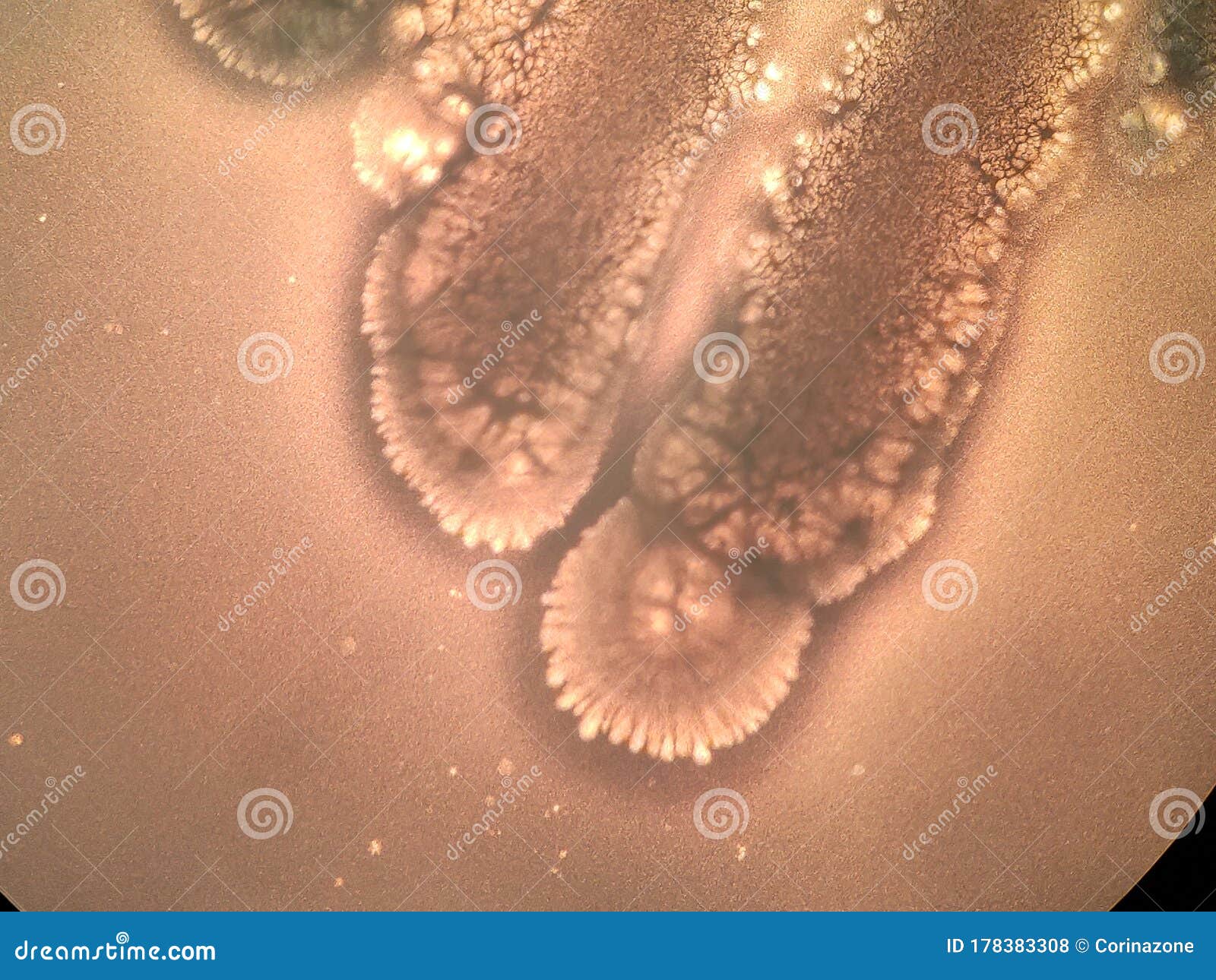 The Beautiful Fractal Pattern of Growth of Bacteria on Nutrient Agar ...