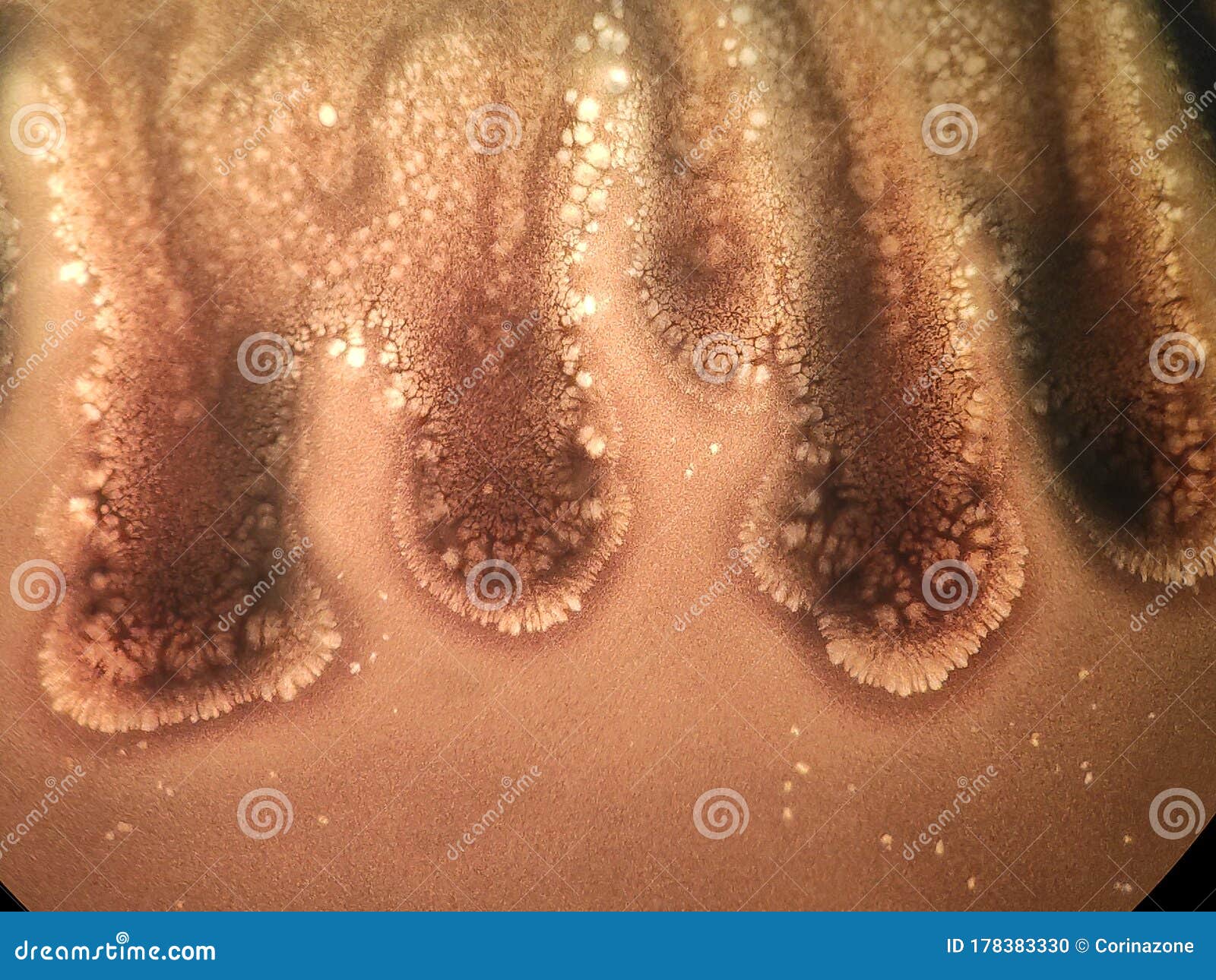 The Beautiful Fractal Pattern of Growth of Bacteria on Nutrient Agar ...