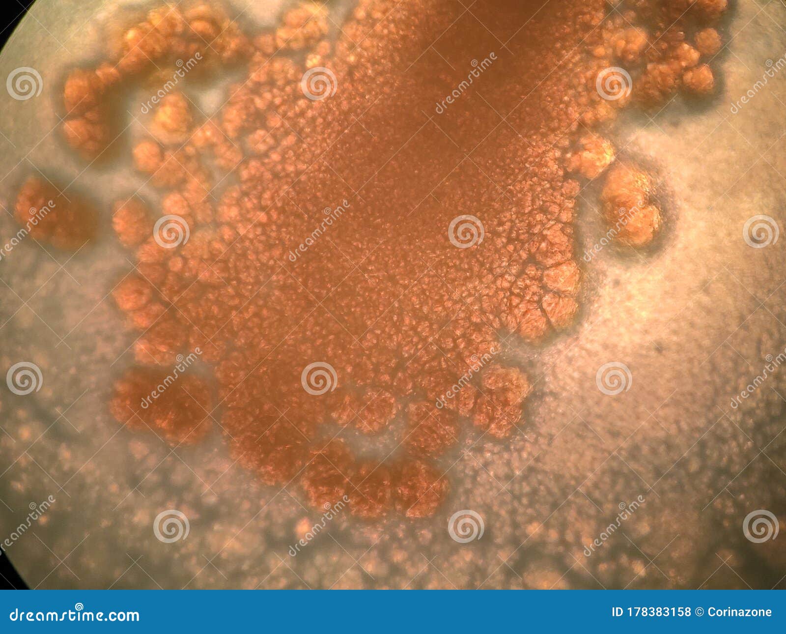 Microscope View of Bacteria Growing in Beautiful Fractal Pattern ...