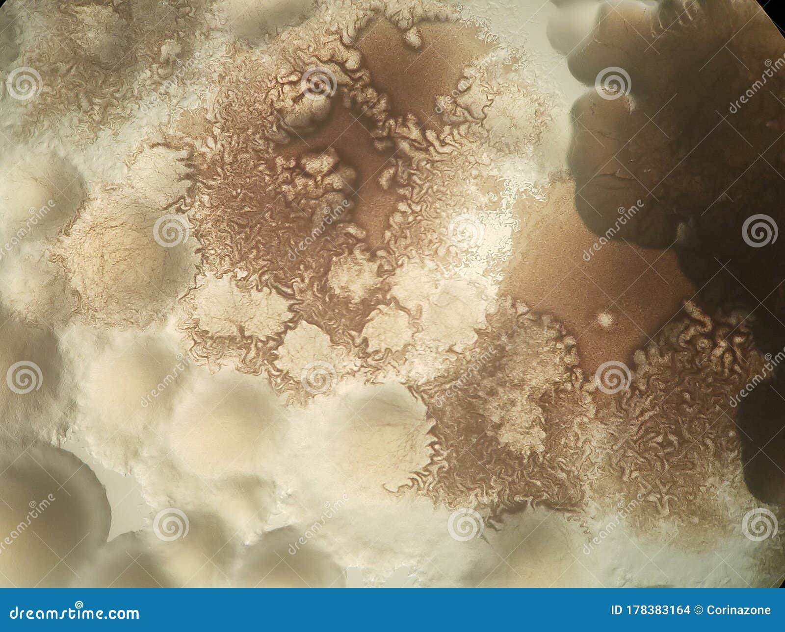 Microscope View of Bacteria Growing in Beautiful Fractal Pattern ...