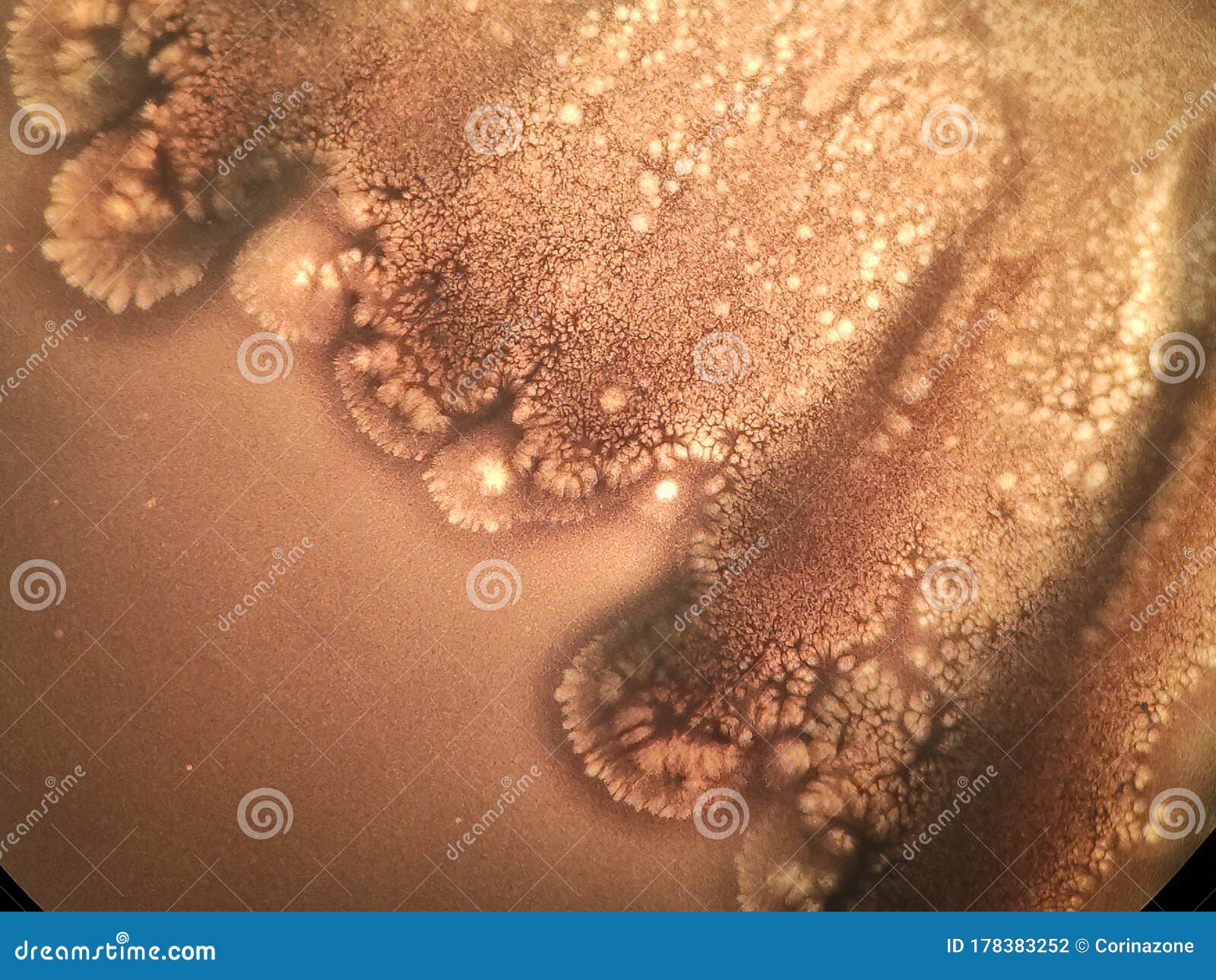 Microscope View of Bacteria Growing in Beautiful Fractal Pattern ...