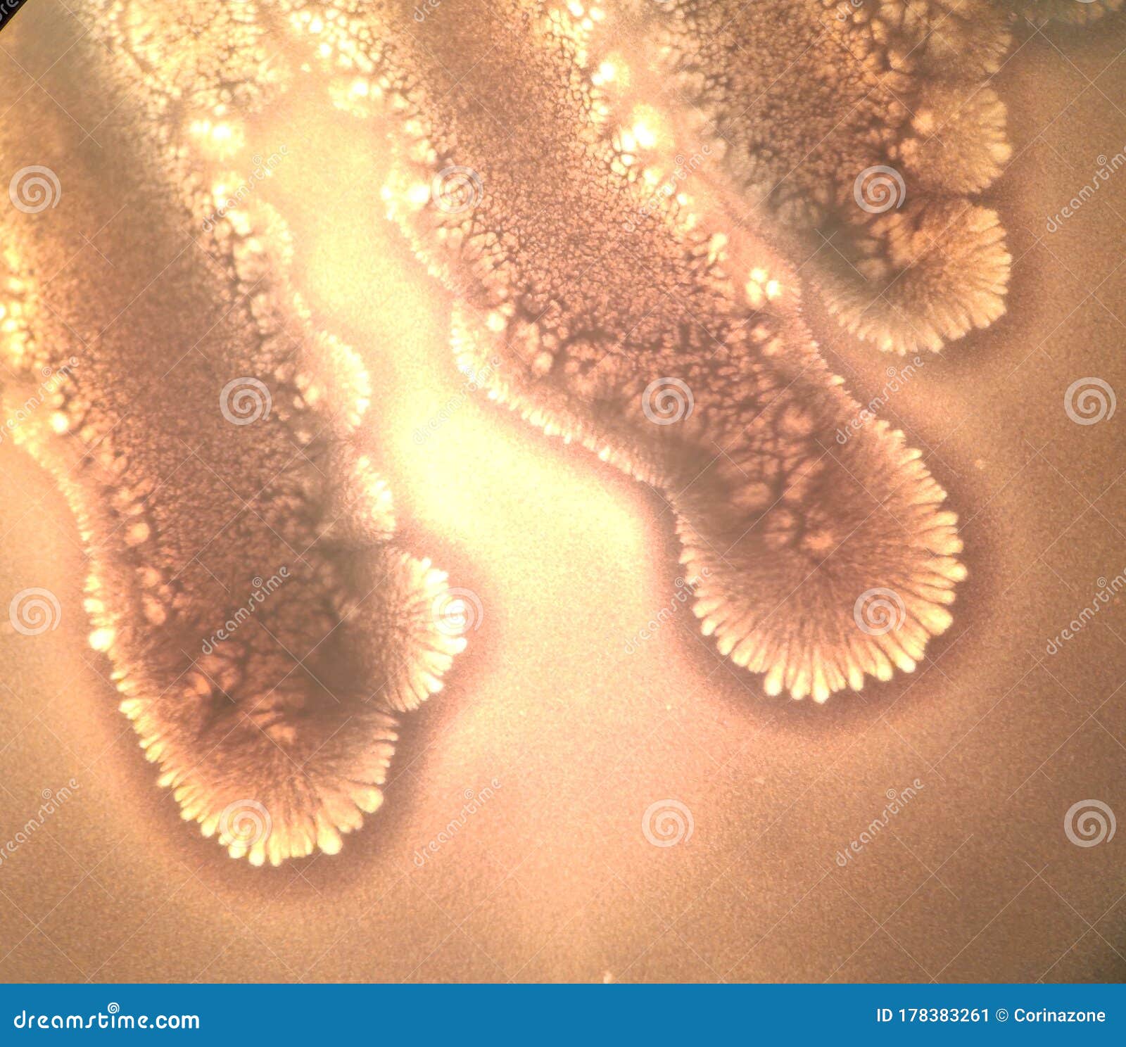Microscope View of Bacteria Growing in Beautiful Fractal Pattern ...