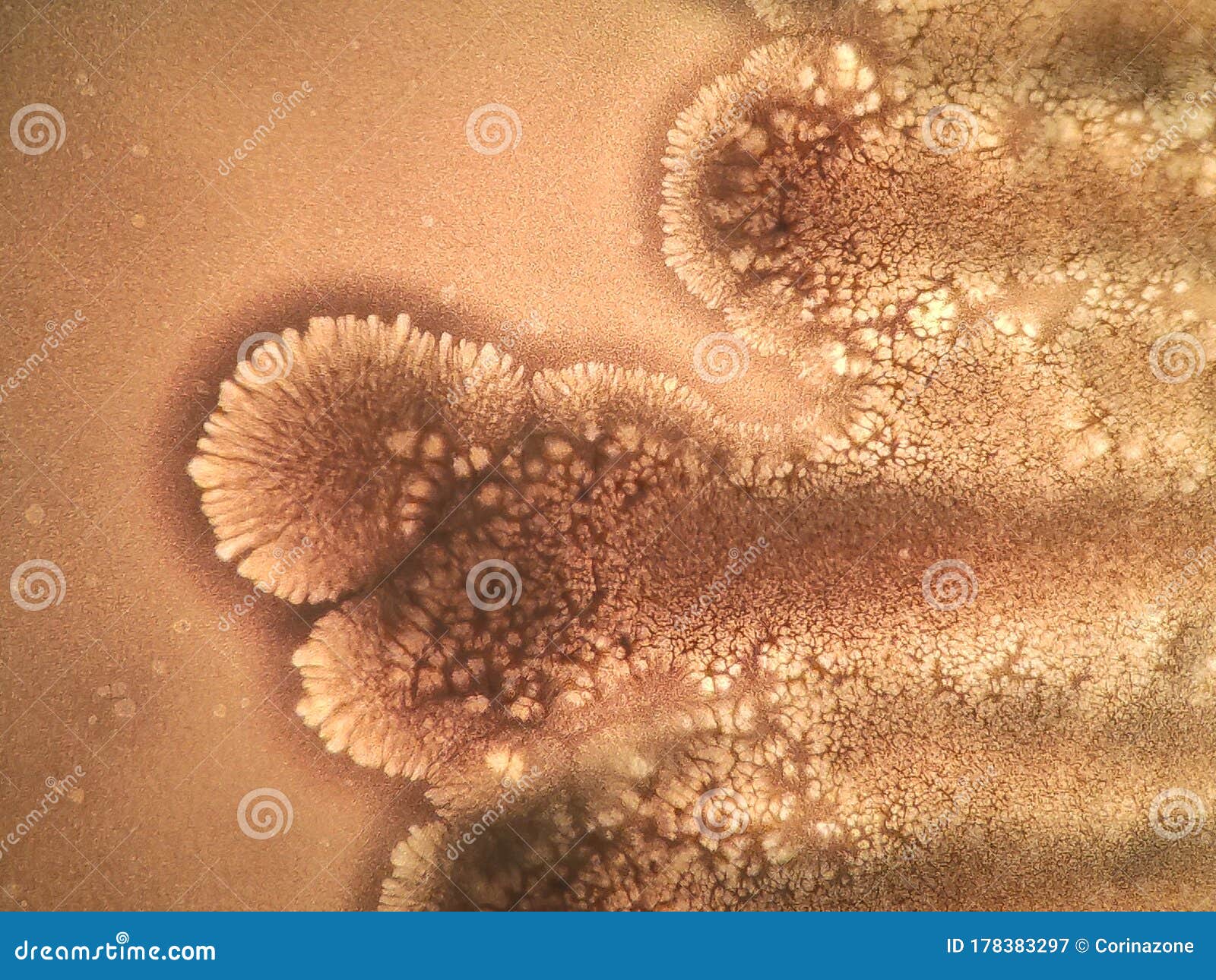 Microscope View of Bacteria Growing in Beautiful Fractal Pattern ...