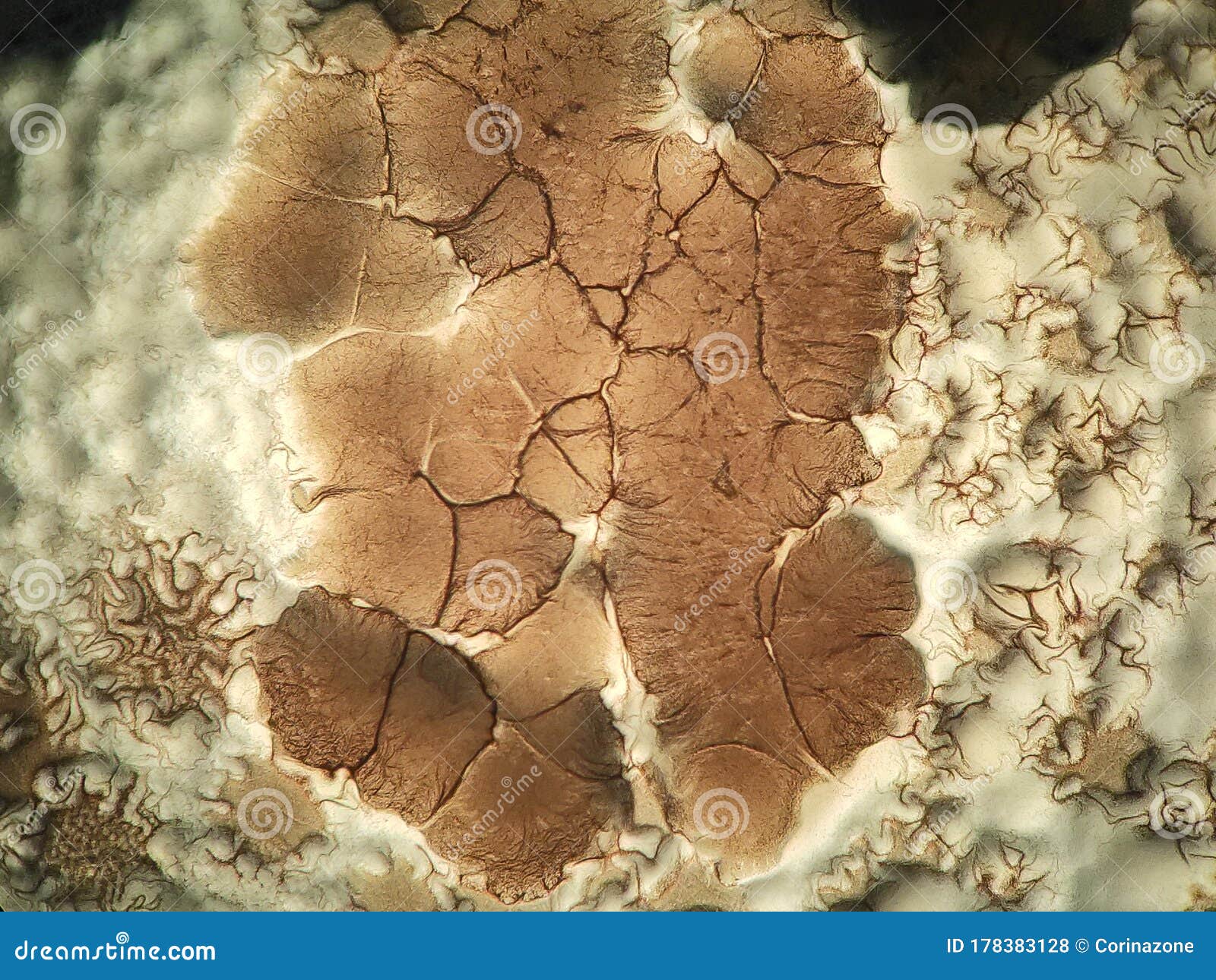 Microscope View Of Bacteria Growing In Beautiful Structures Stock ...