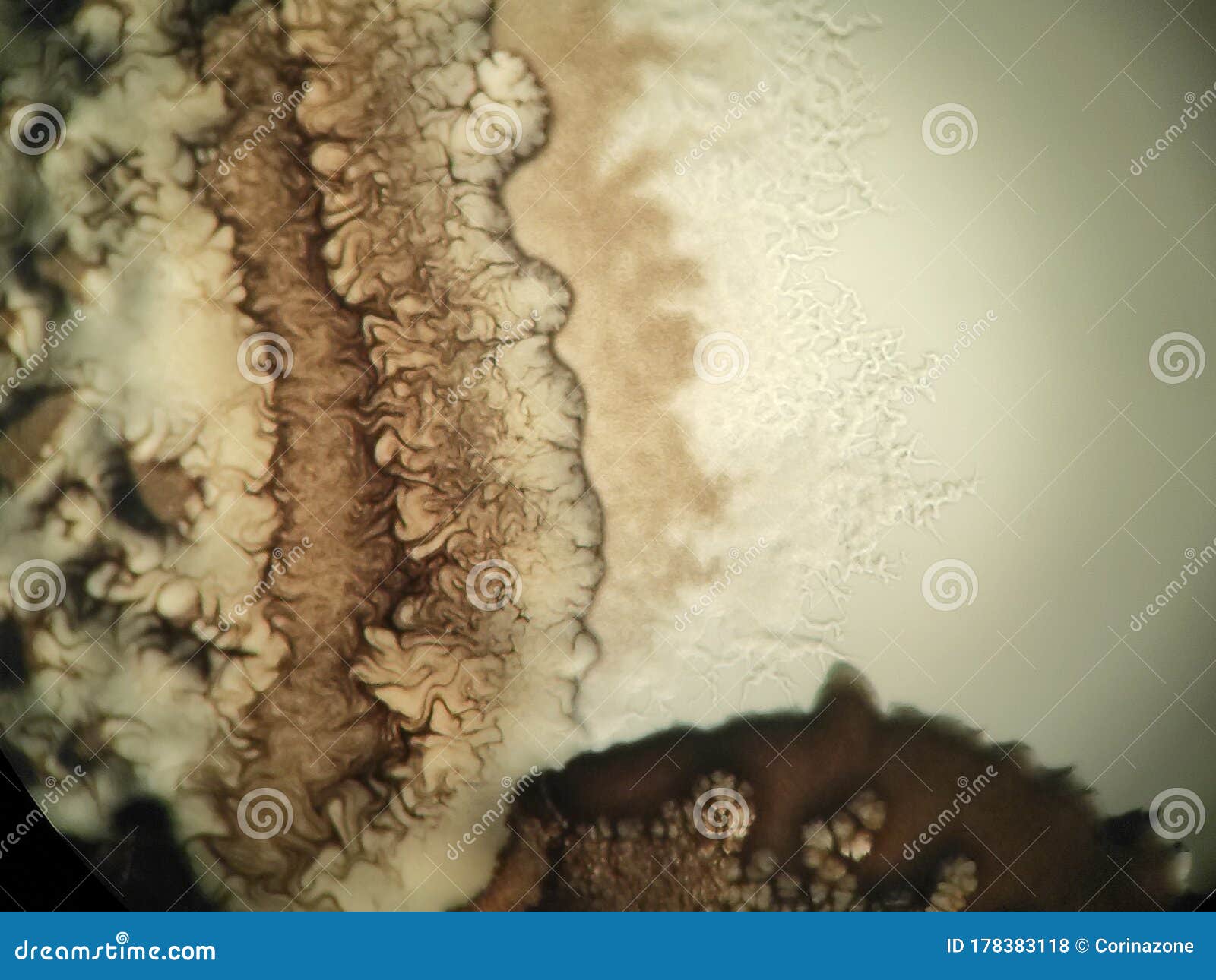 Microscope View of Bacteria Growing in Beautiful Structures Stock Photo ...