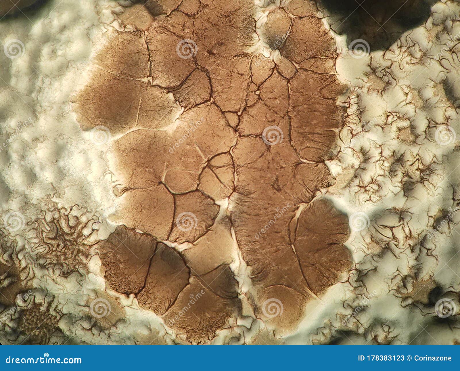 Microscope View of Bacteria Growing in Beautiful Structures Stock Image ...