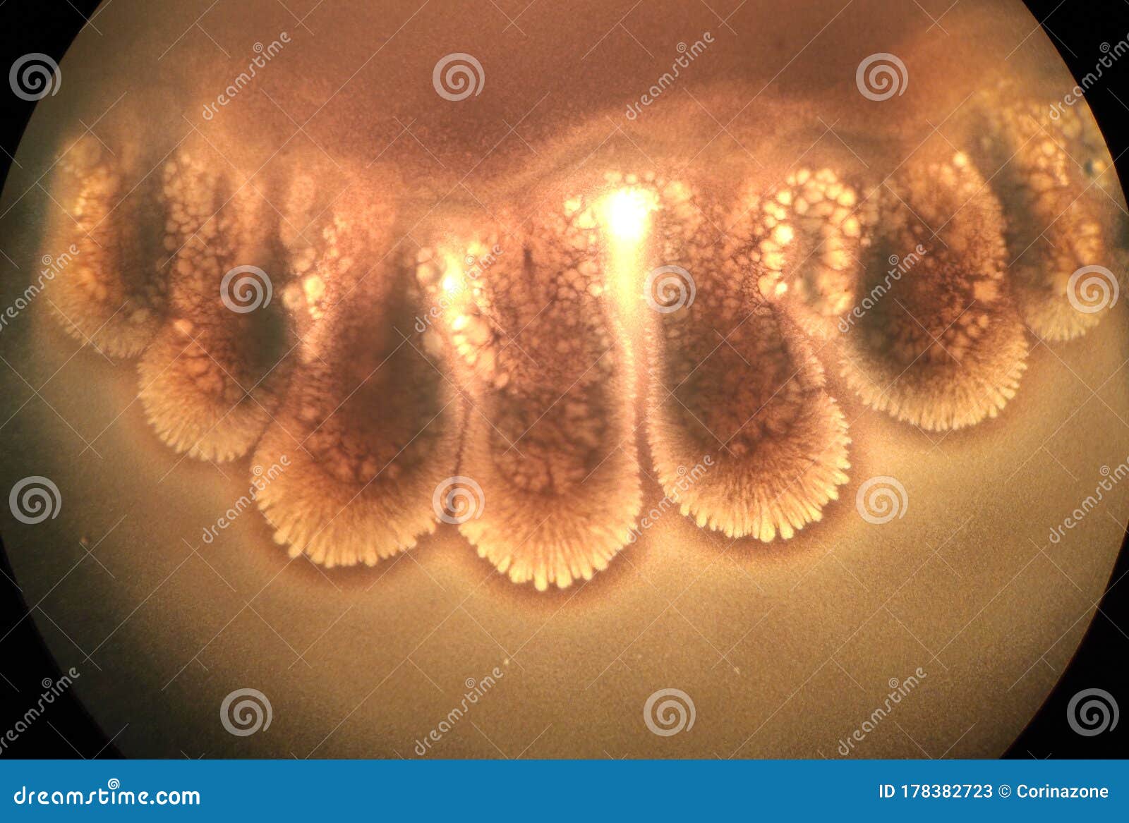 Microscope View of Bacteria Growing in Beautiful Fractal Pattern ...