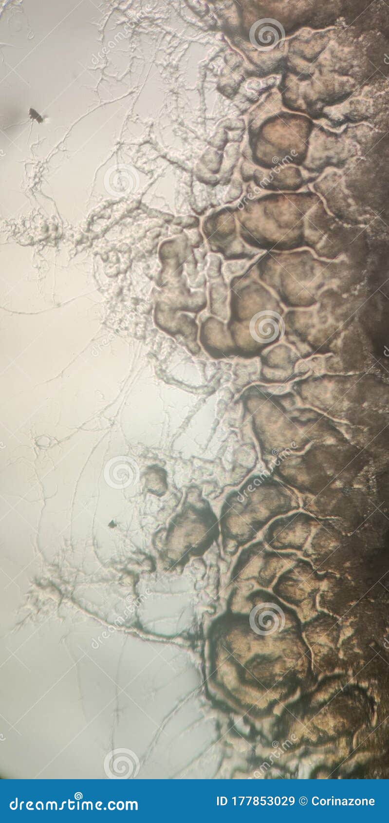 Beautiful Bacterial Colony Under the Microscope Stock Image - Image of ...