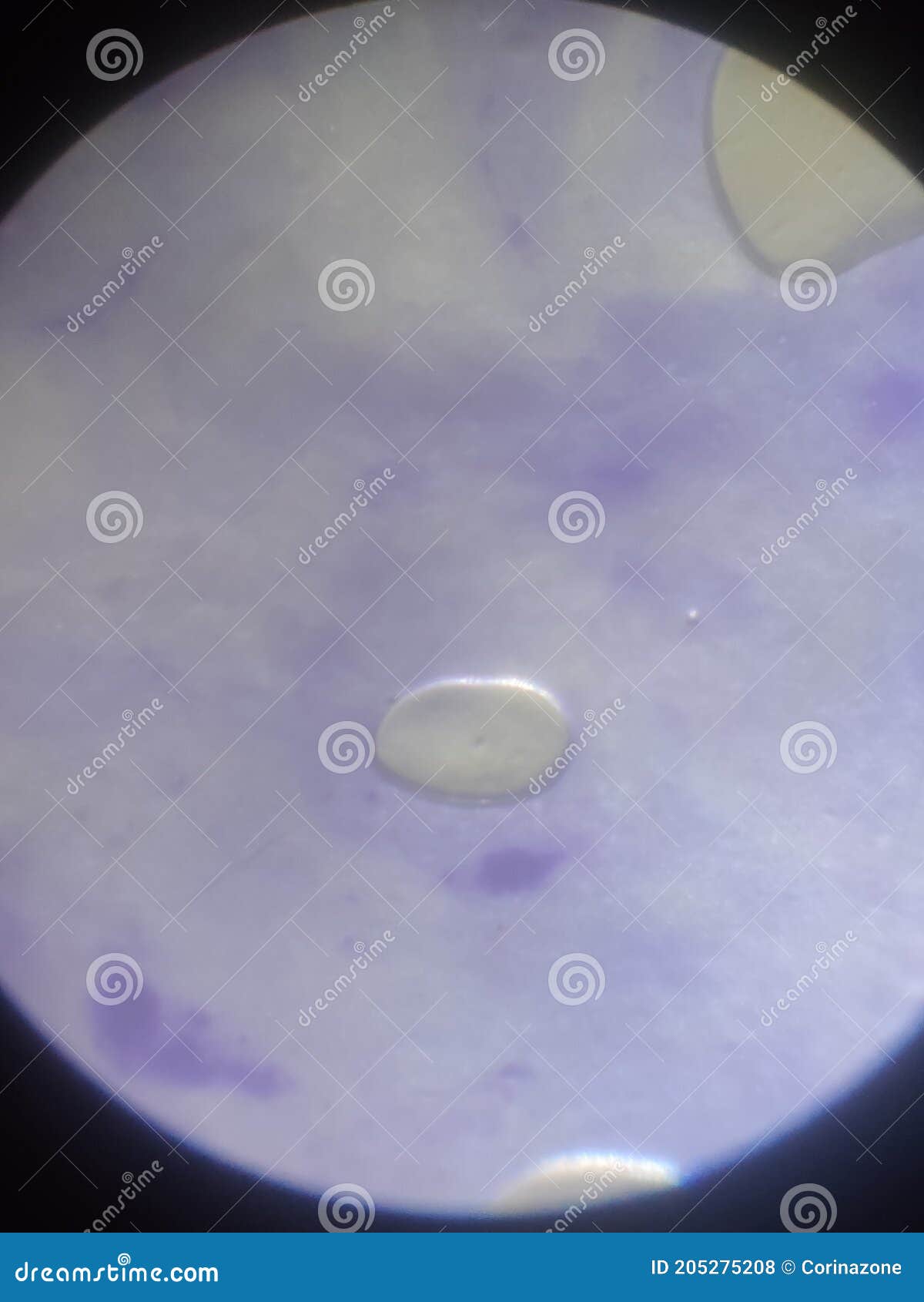 The Brain of a Pig Under the Microscope Stock Photo - Image of biology ...