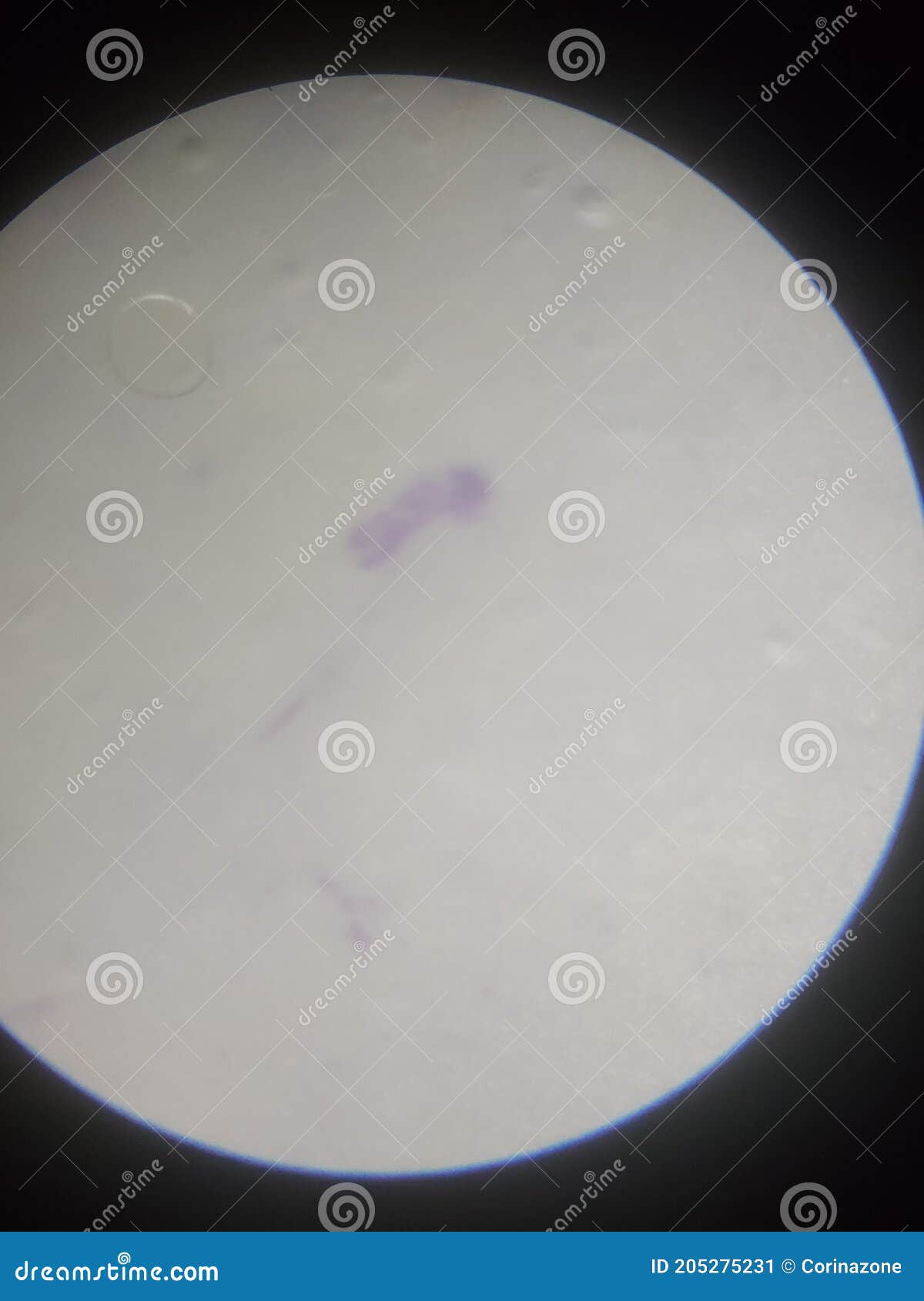 The Brain of a Pig Under the Microscope Stock Image - Image of biology ...