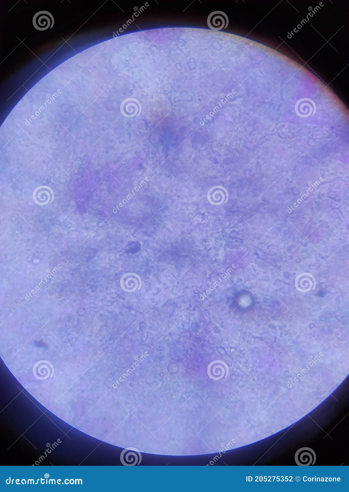 The Brain of a Pig Under the Microscope Stock Photo - Image of ...