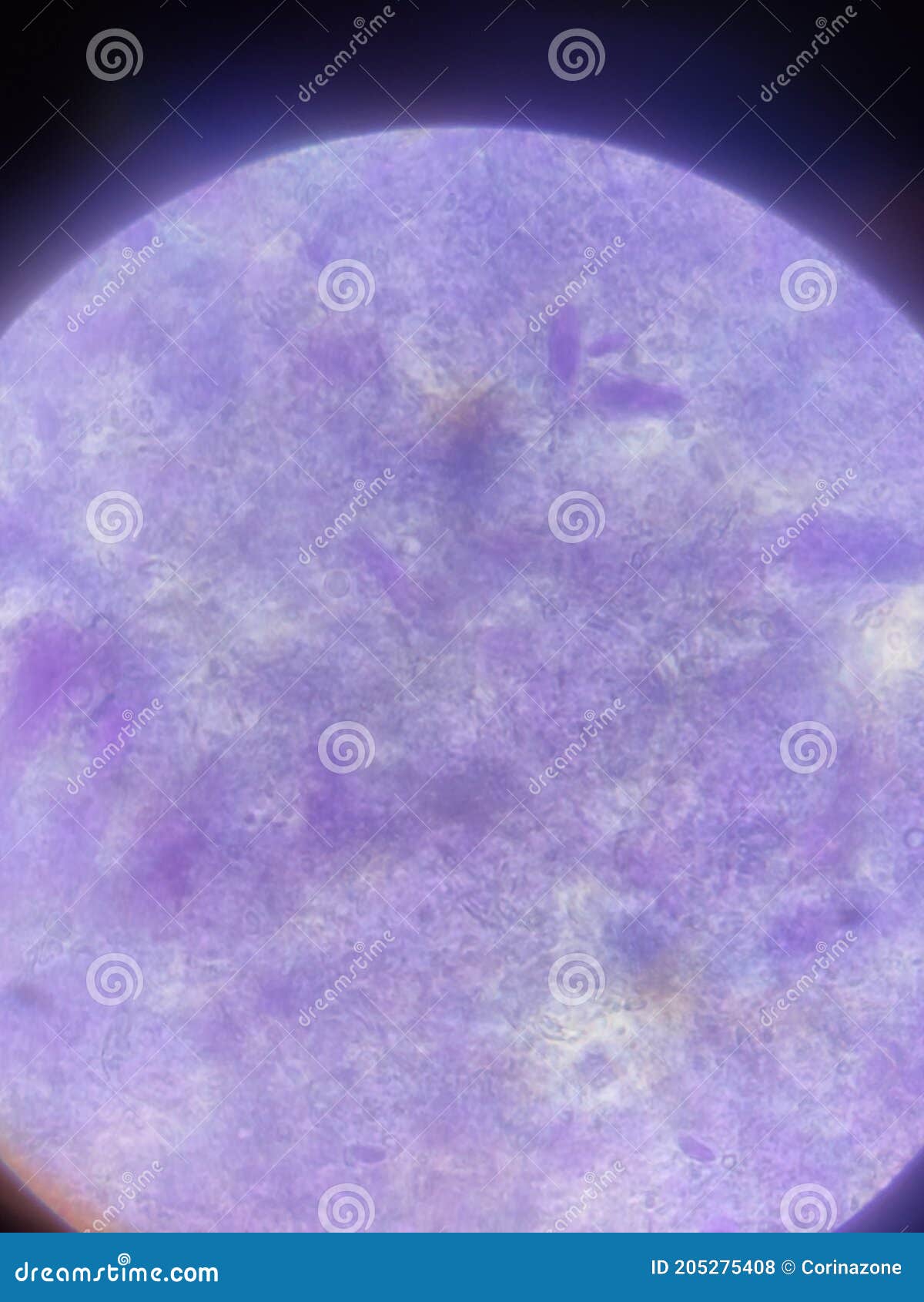 The Brain of a Pig Under the Microscope Stock Photo - Image of ...